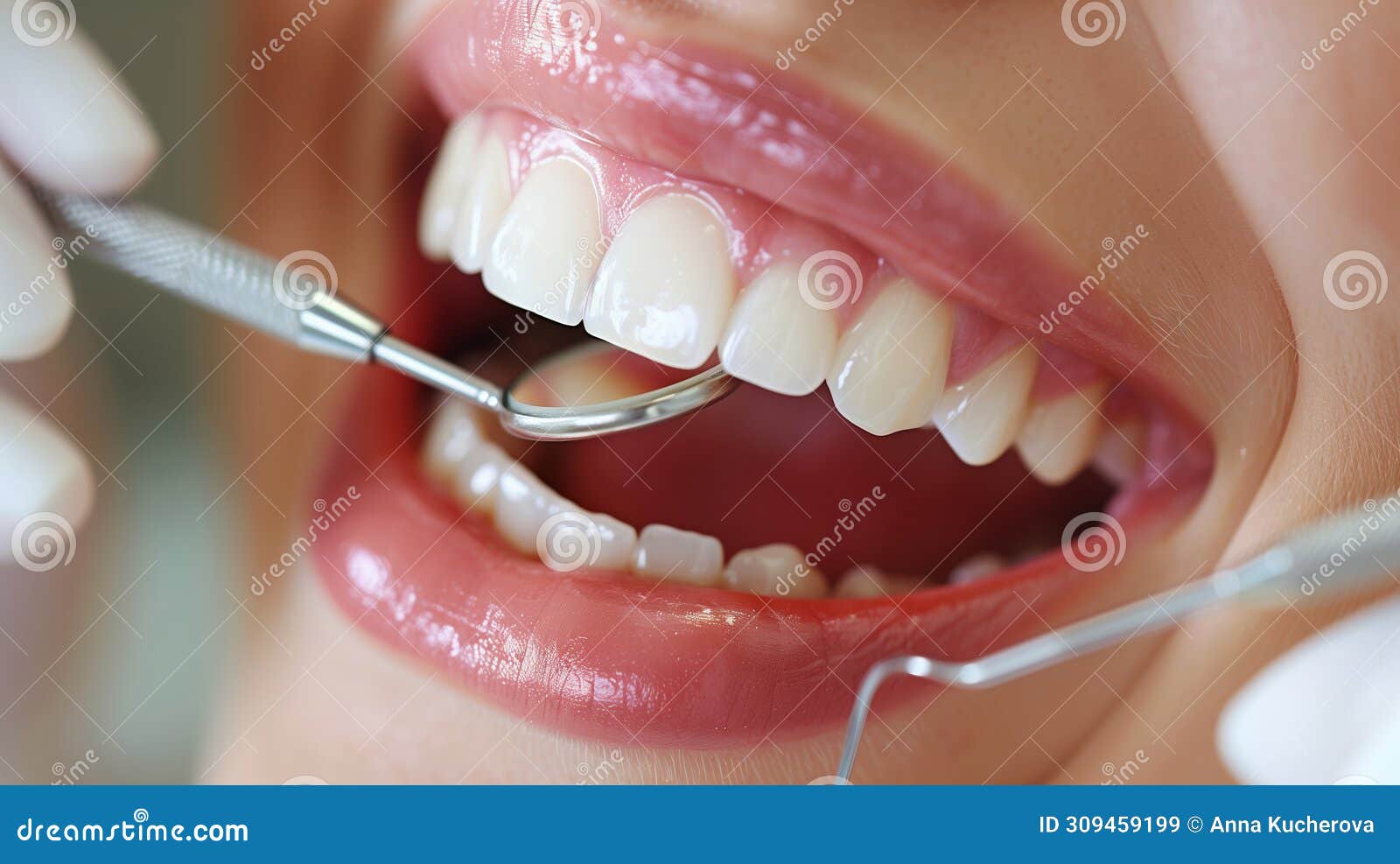Dental Examination, with a Focus on Healthy White Teeth and Dental ...