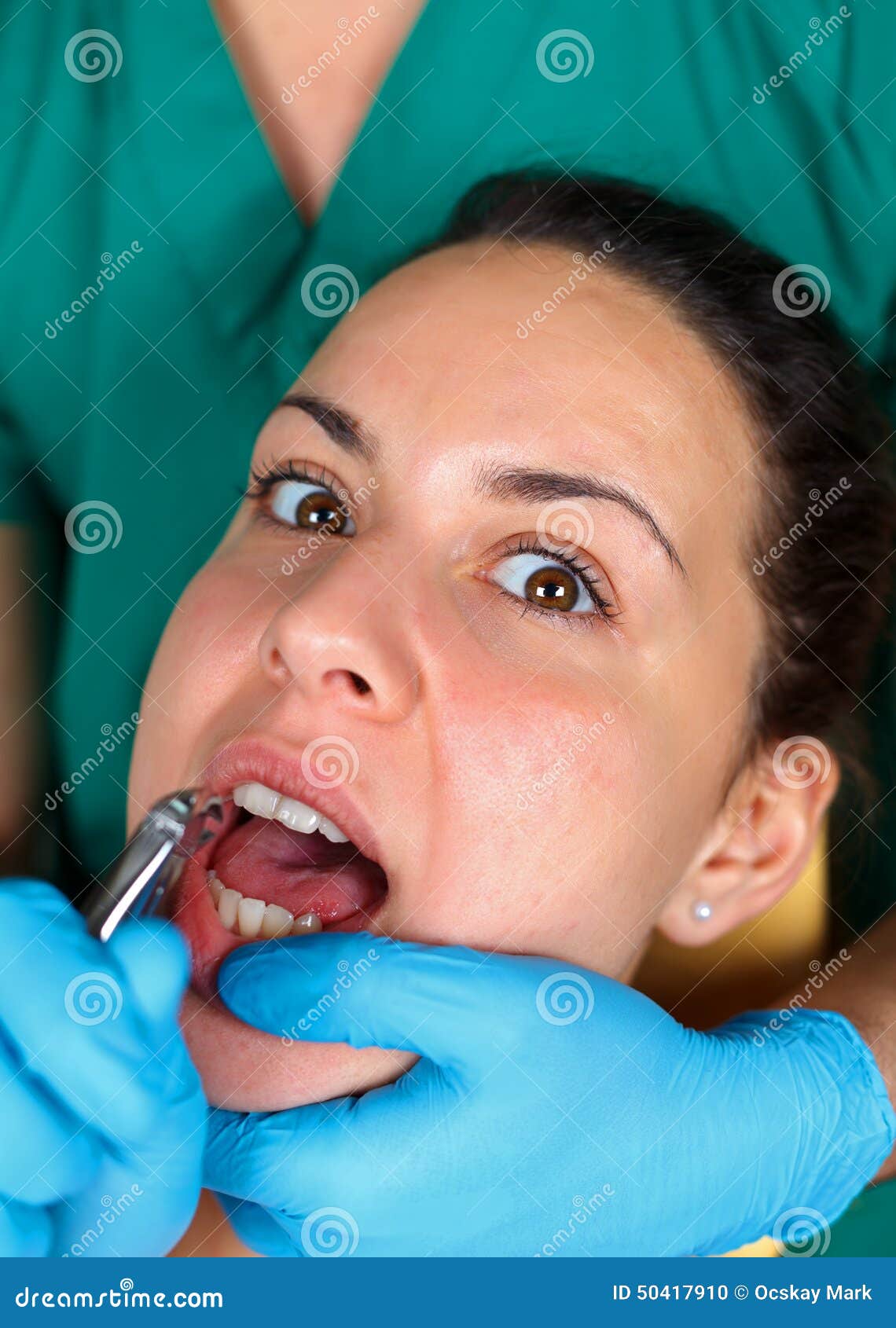 Dental extraction stock photo. Image of biofilm, care - 50417910