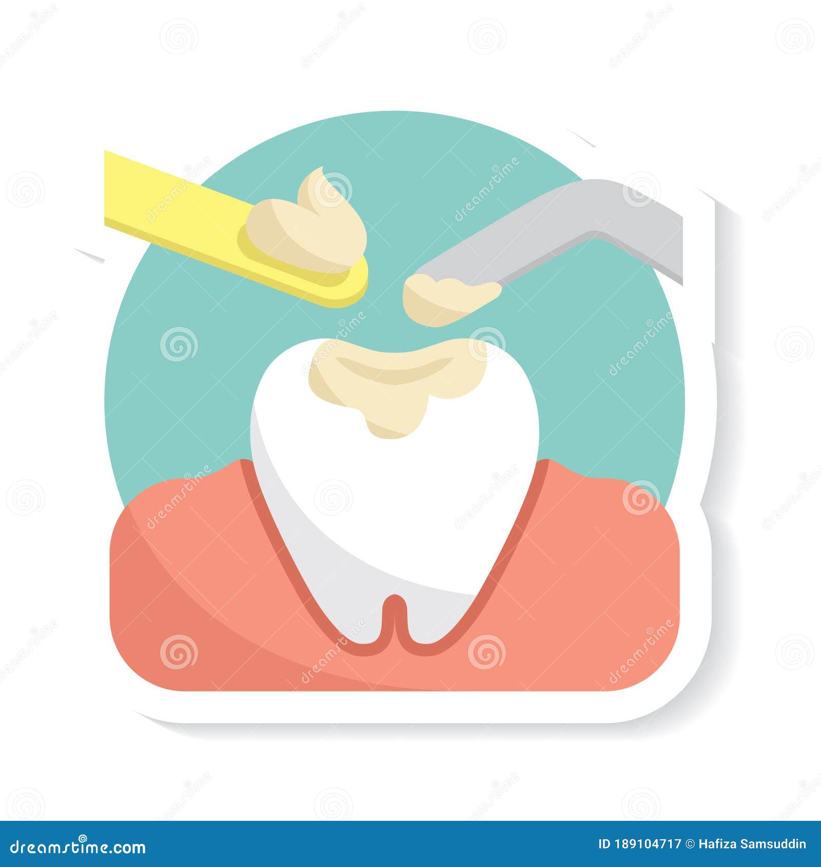 Dental Filling Procedure. Amalgam Silver Filling And Composite Tooth ...