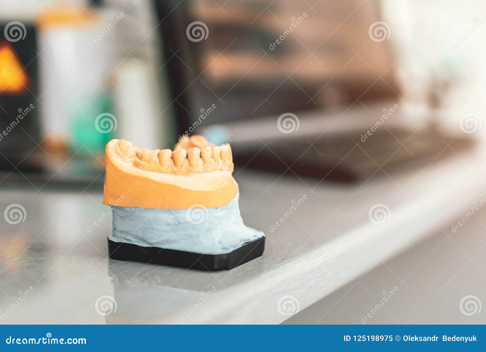 Dental Gypsum Model of the Teeth in the Cliinic Stock Image - Image of ...