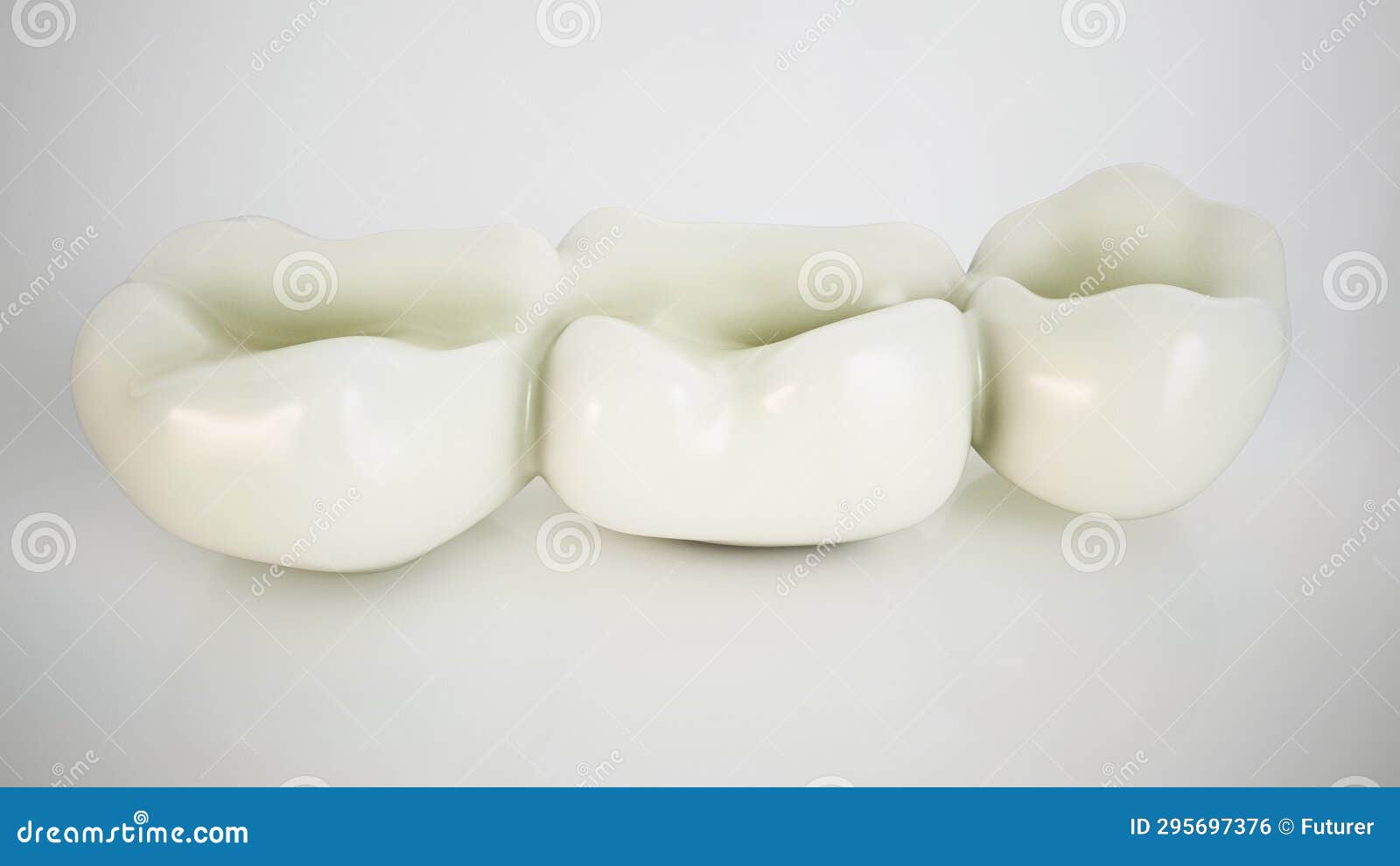 Dental Implant: Modern Solution for Tooth Replacement Stock Photo ...
