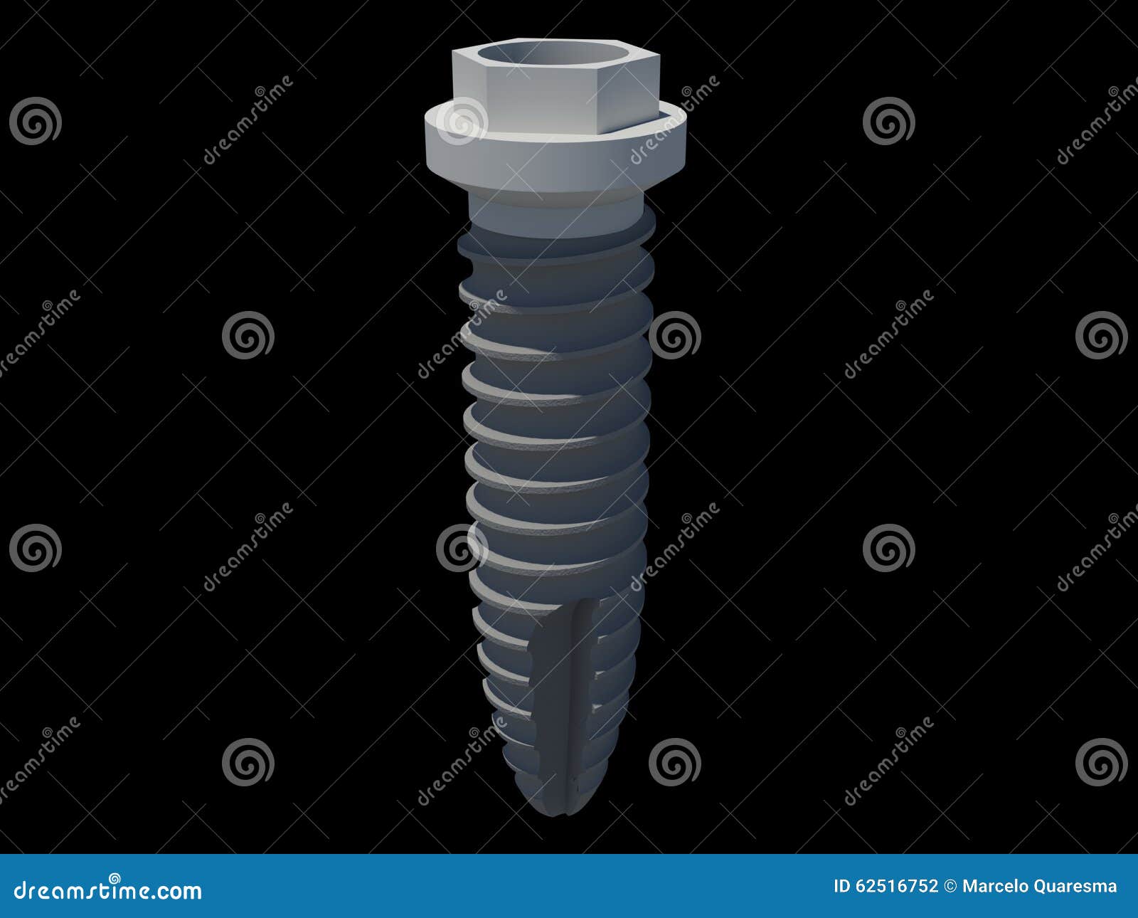 Dental Implant External Hexagon Stock Illustration - Illustration of ...