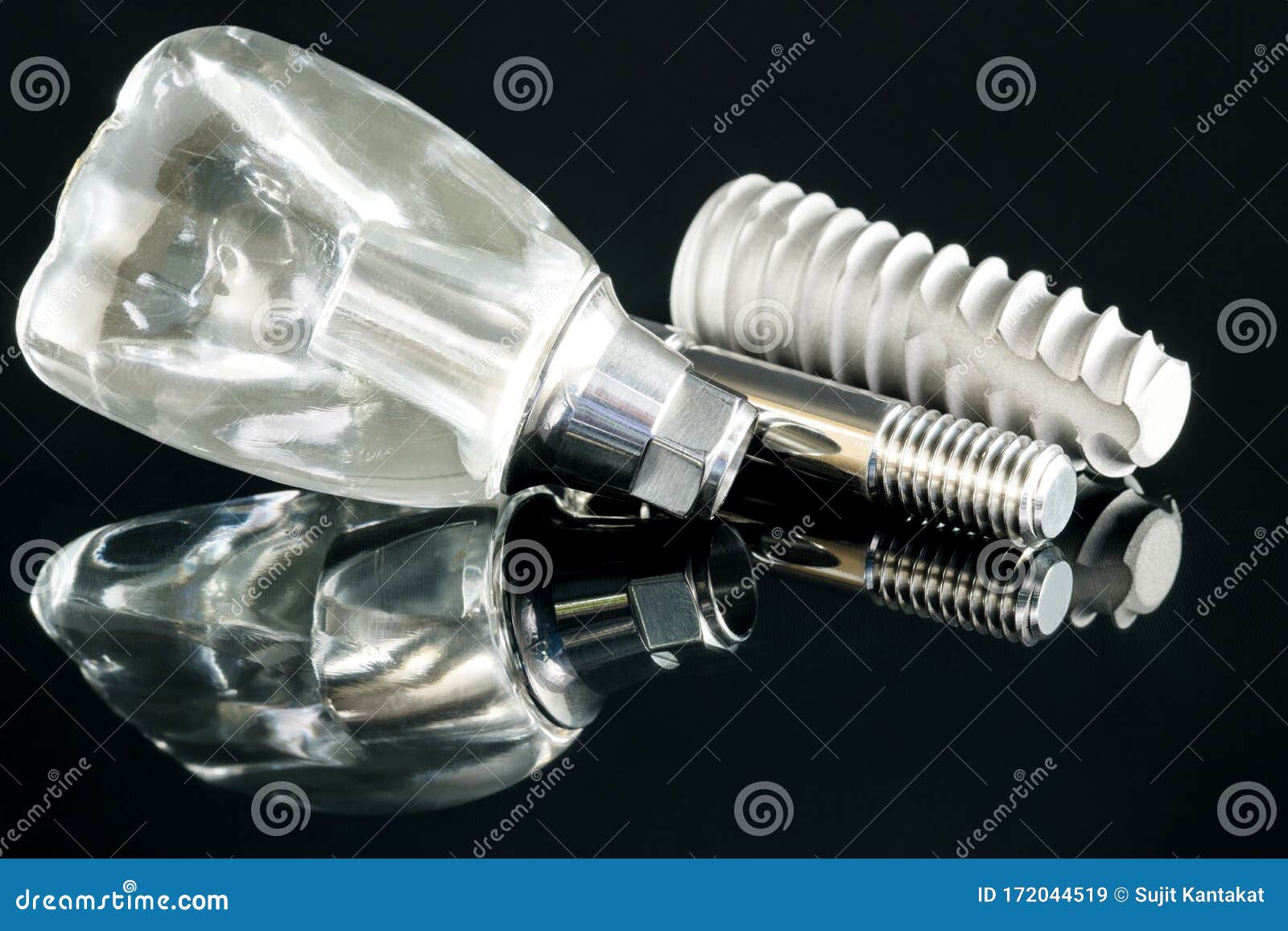 Dental implant model. stock image. Image of healthy - 172044519