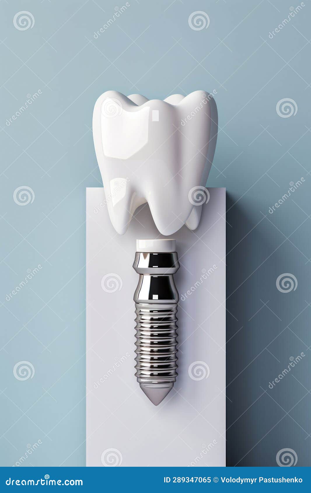 Dental Implant is Mounted on Wall with Tooth. Generative AI Stock Image ...