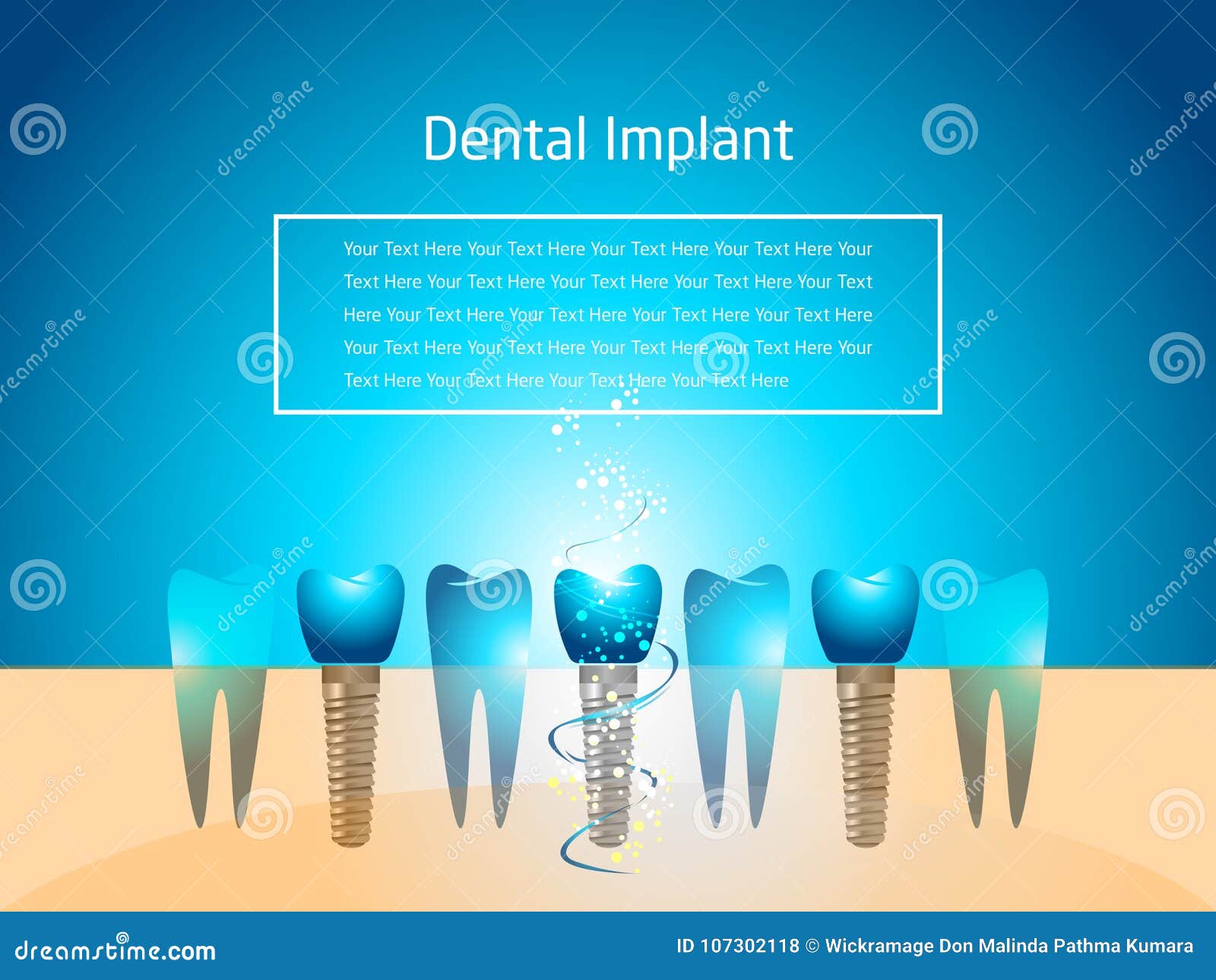 Dental Implant Wallpaper