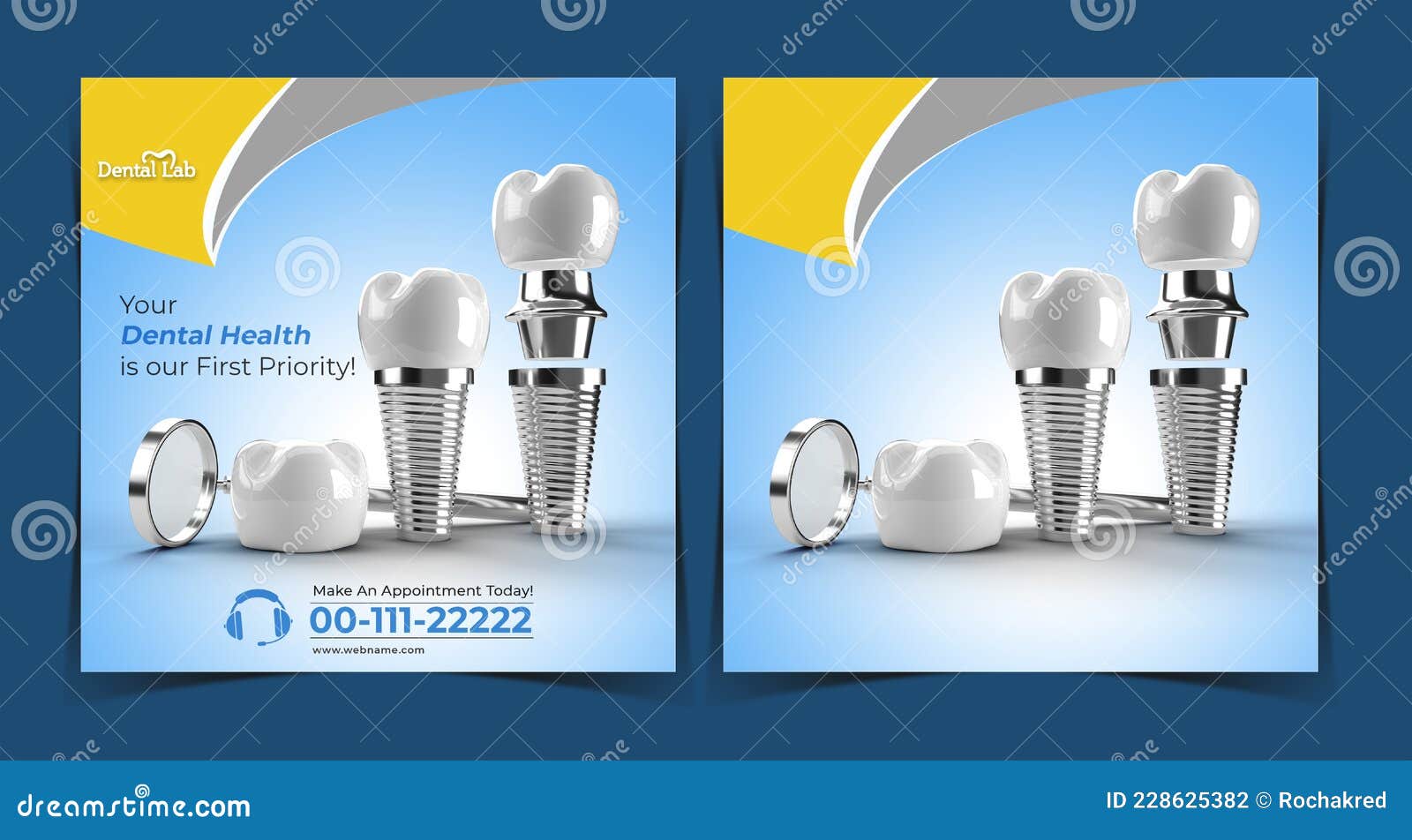 Dental Implants Surgery Concept Instagram Post Banner Template Stock ...