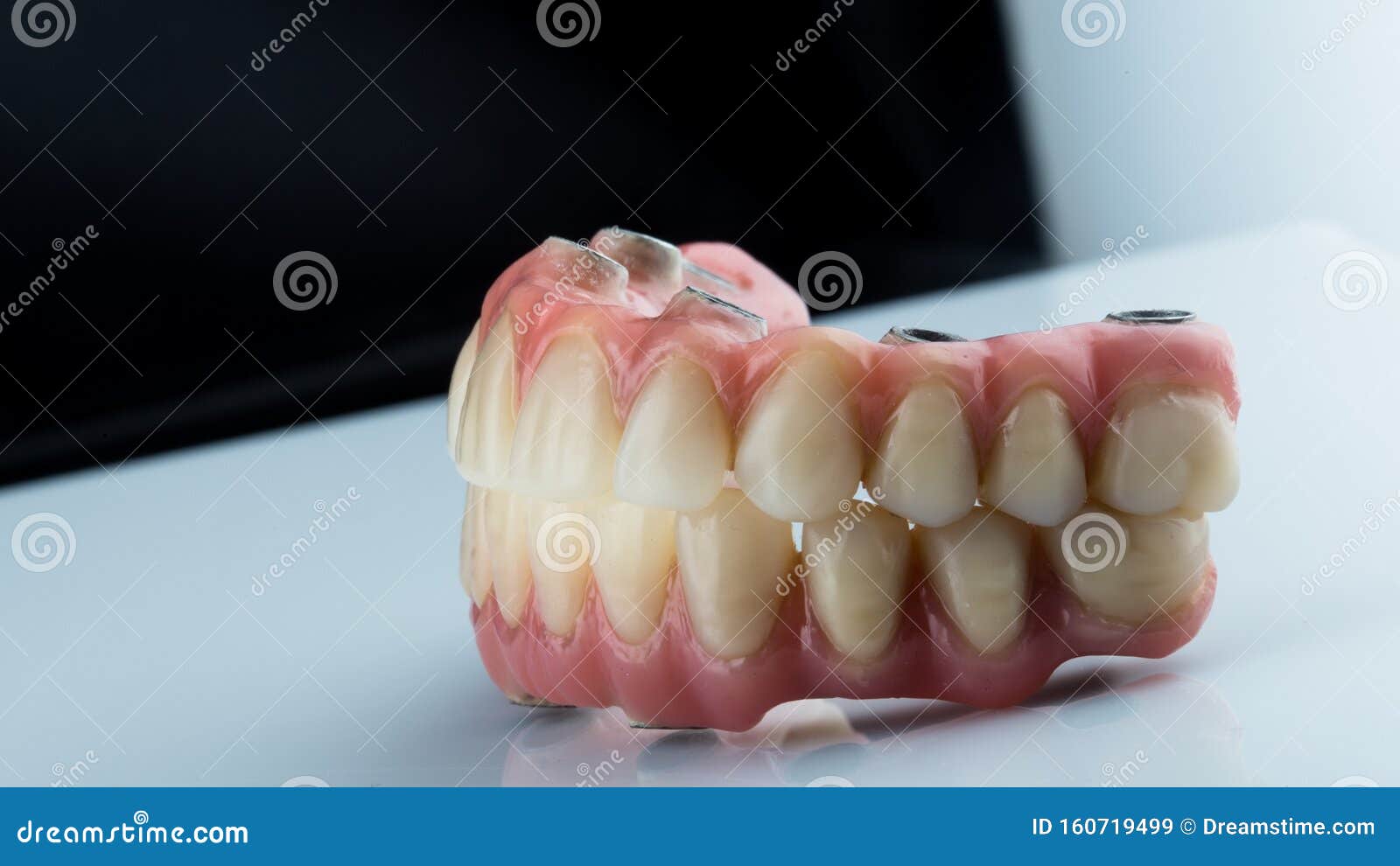 Dentures on a White Background, Dental Implants Stock Image - Image of ...