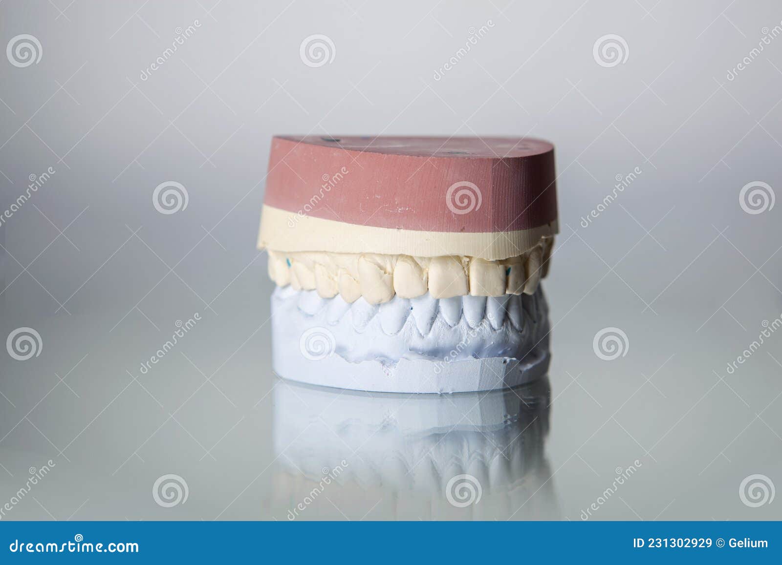 Dental impression stock image. Image of production, dental - 231302929