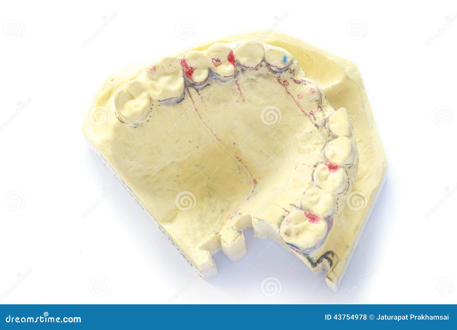 Dental Impression Model with Laboratory Design Stock Photo - Image of ...