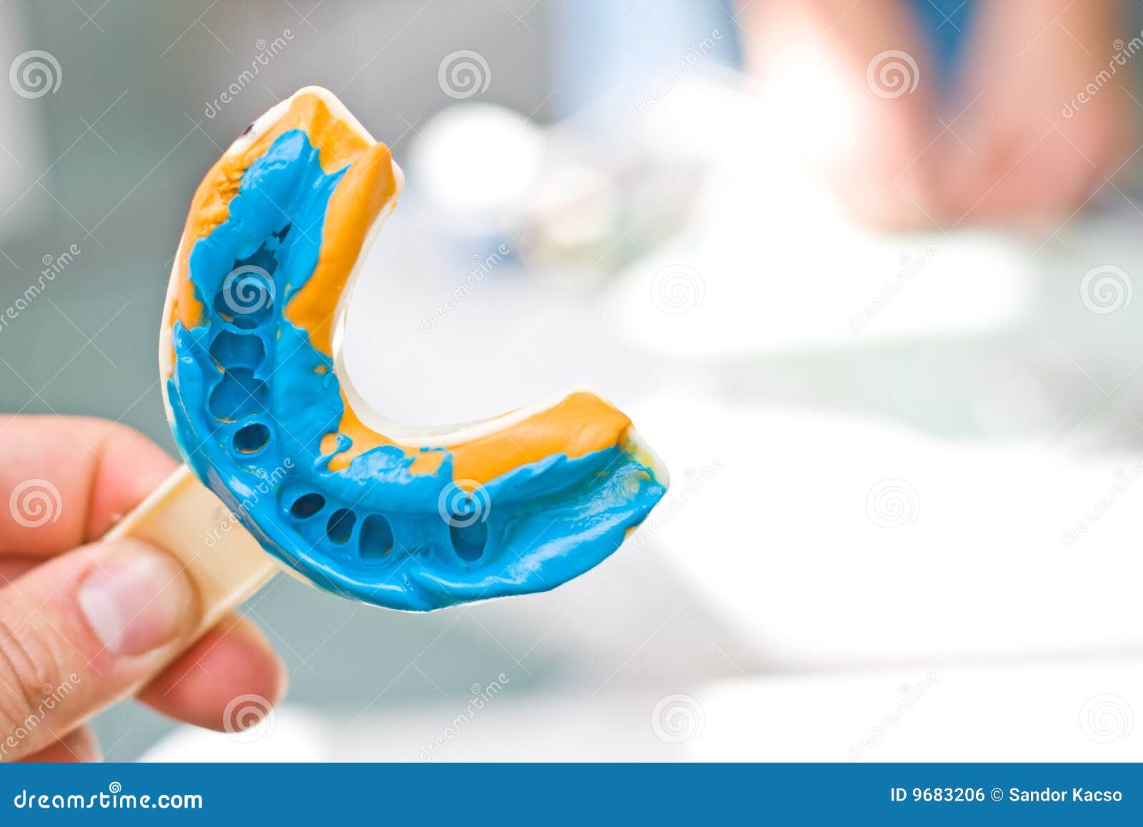 Dental imprint stock photo. Image of appliance, tooth - 9683206