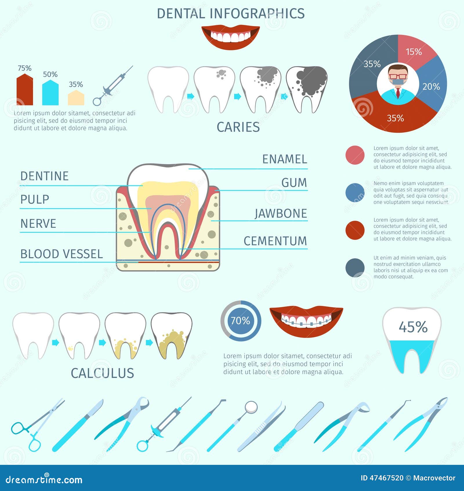 Dental infographics set stock vector. Illustration of metal - 47467520