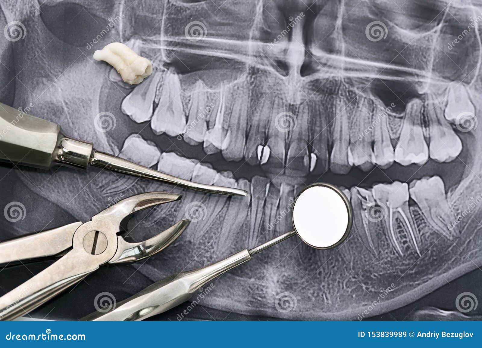 Orthopantomogram Stock Photos - Download 88 Royalty Free Photos
