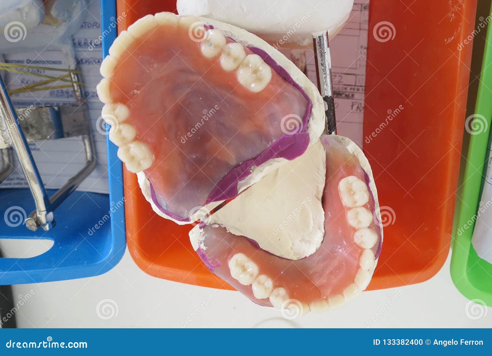 Impressions Dental