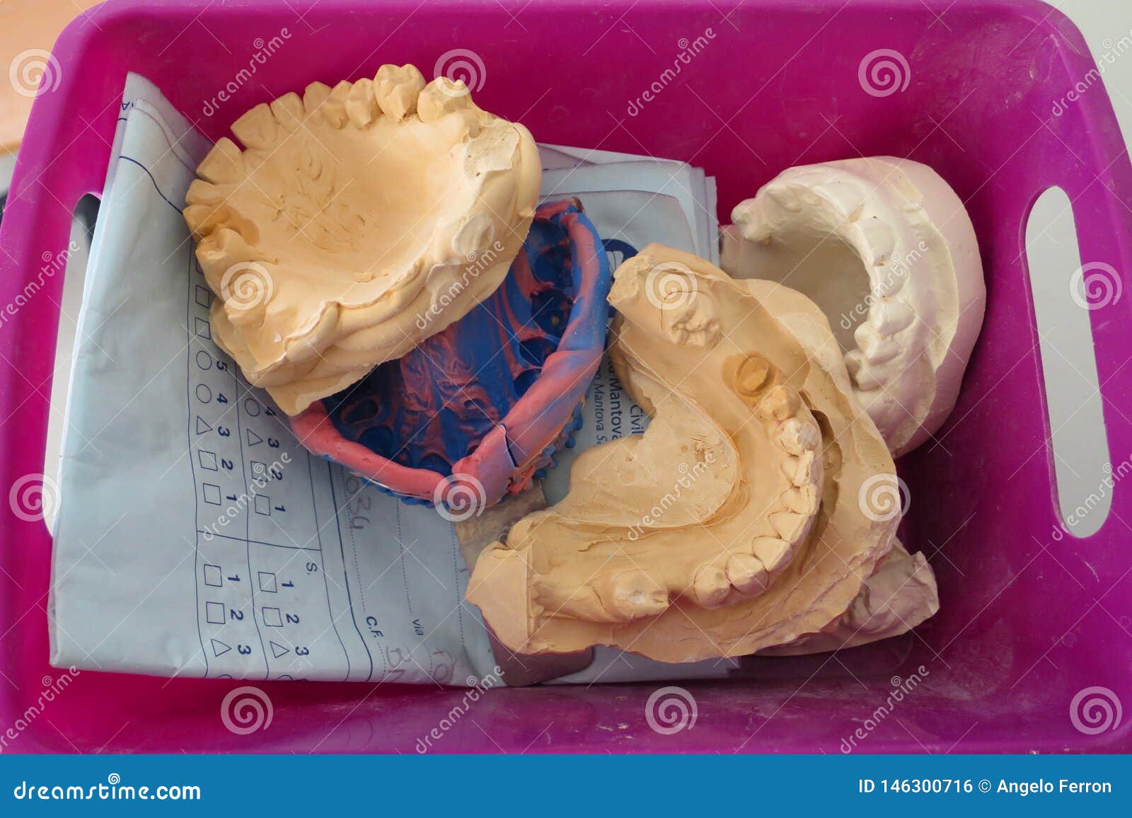 Dental Laboratory Denture Dental Impressions Stock Photo - Image of ...