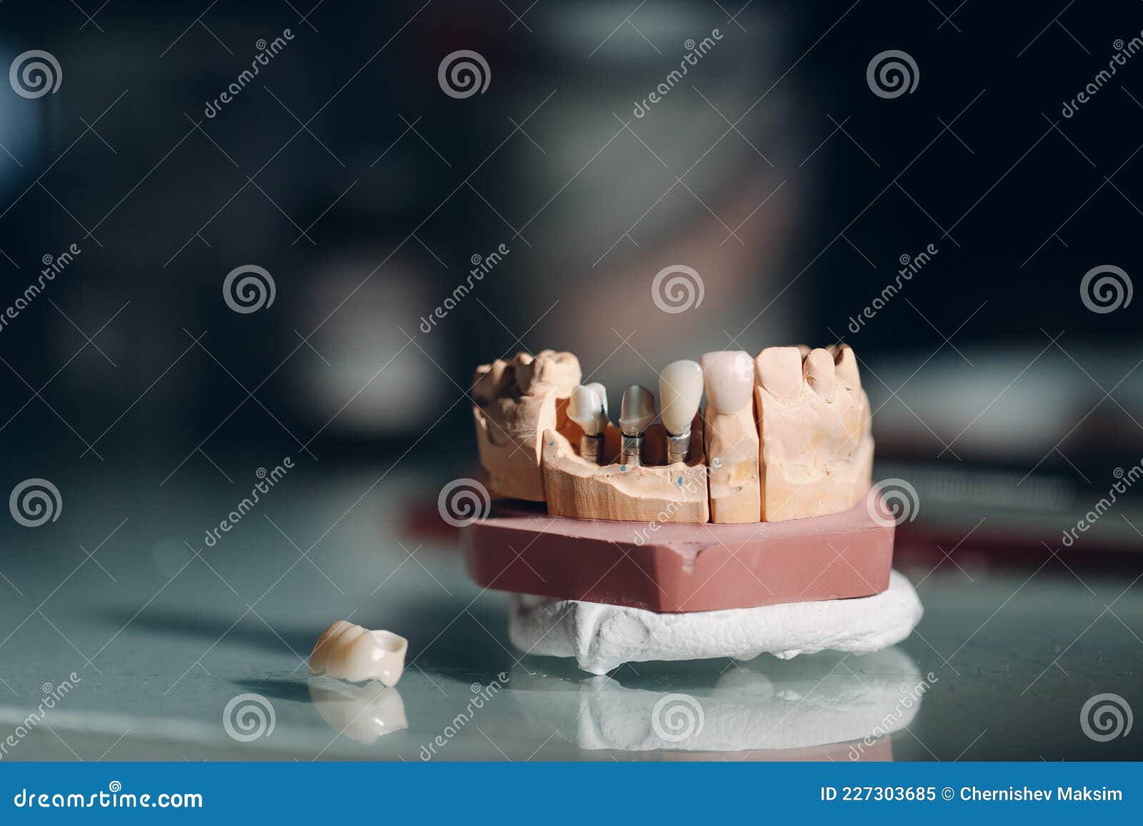 Denture Layout. Technician Takes Ready-made Tooth Models From The Oven ...