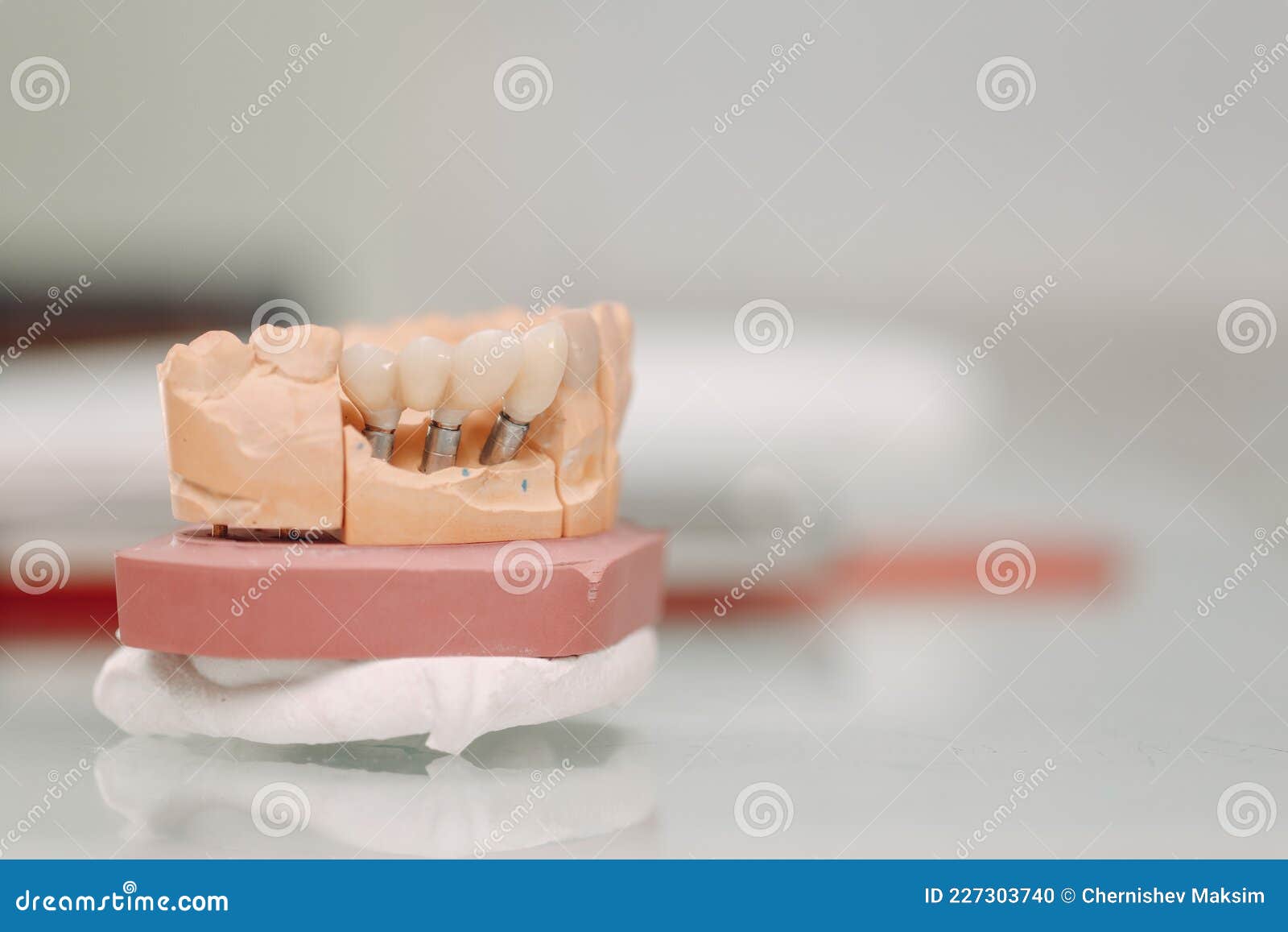 Denture Layout. Technician Takes Ready-made Tooth Models From The Oven ...