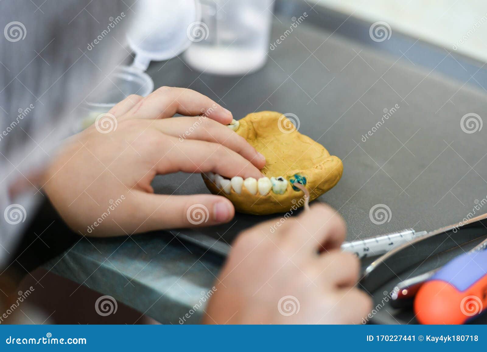 Dental Layout and Tooth Decay. False Teeth. Training Class in Dentistry ...