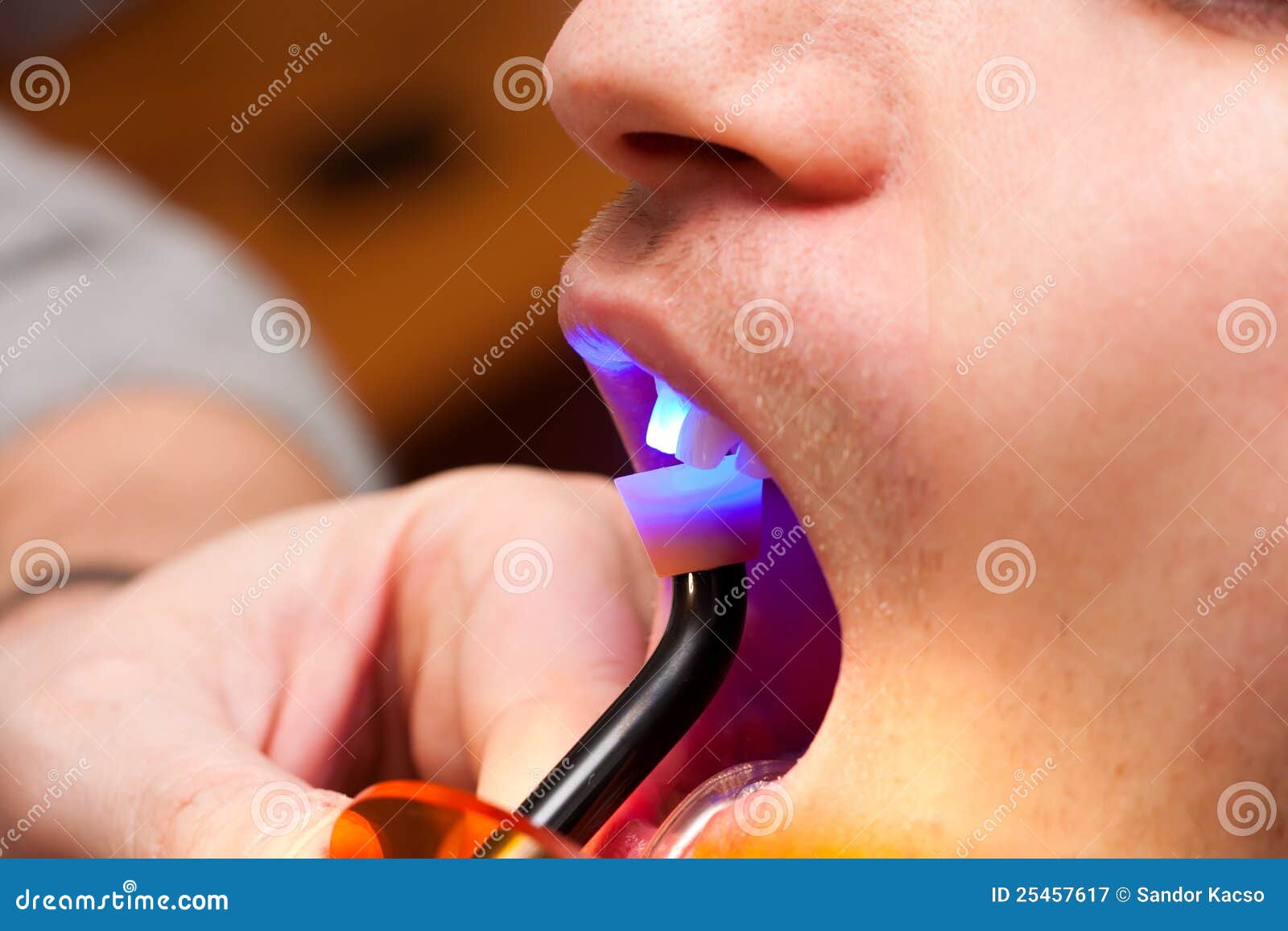Dental light stock image. Image of medicine, dentist - 25457617