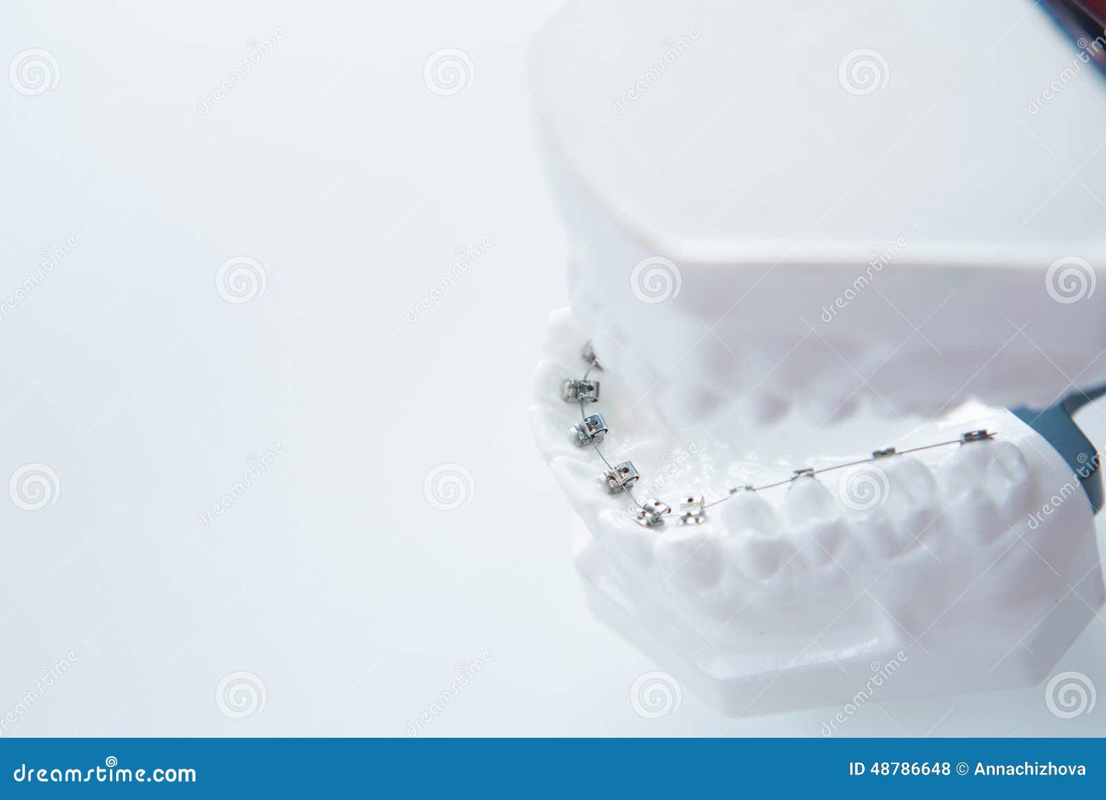 Dental Lower Jaw Bracket Braces Model on White Stock Photo - Image of ...