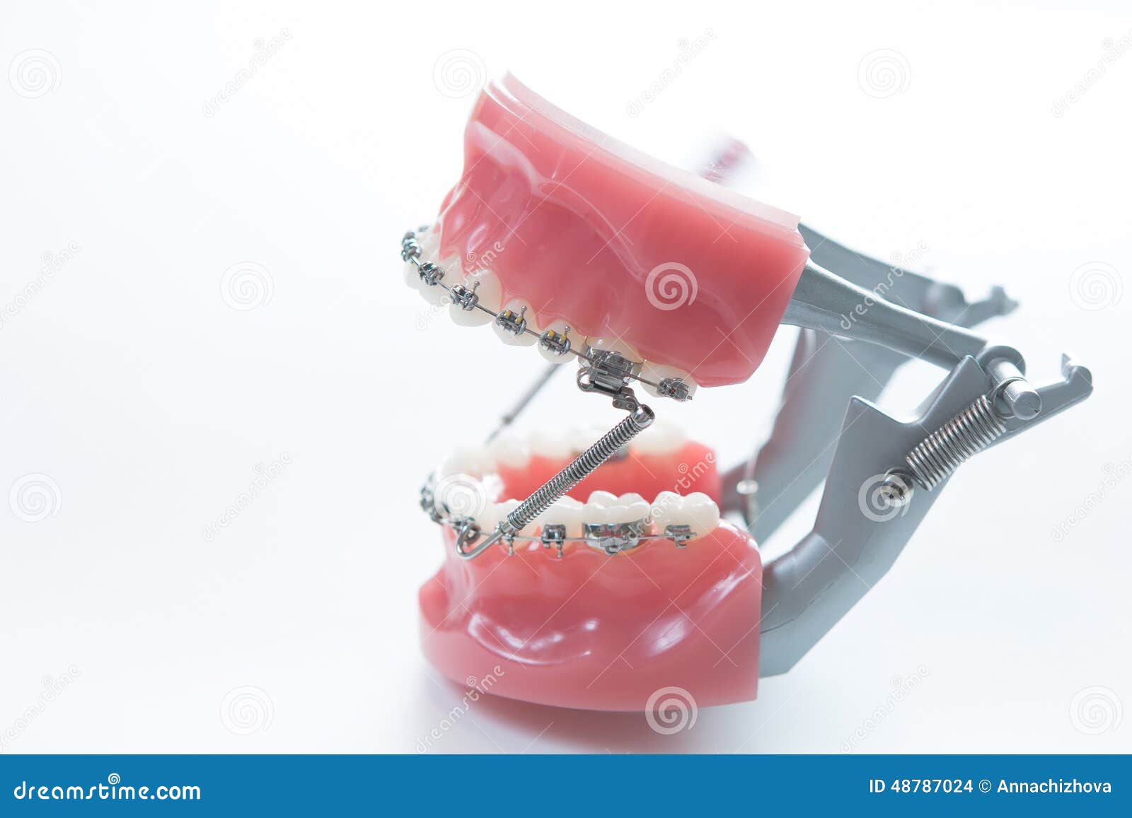 Dental Lower Jaw Bracket Braces Model on White Stock Photo - Image of ...