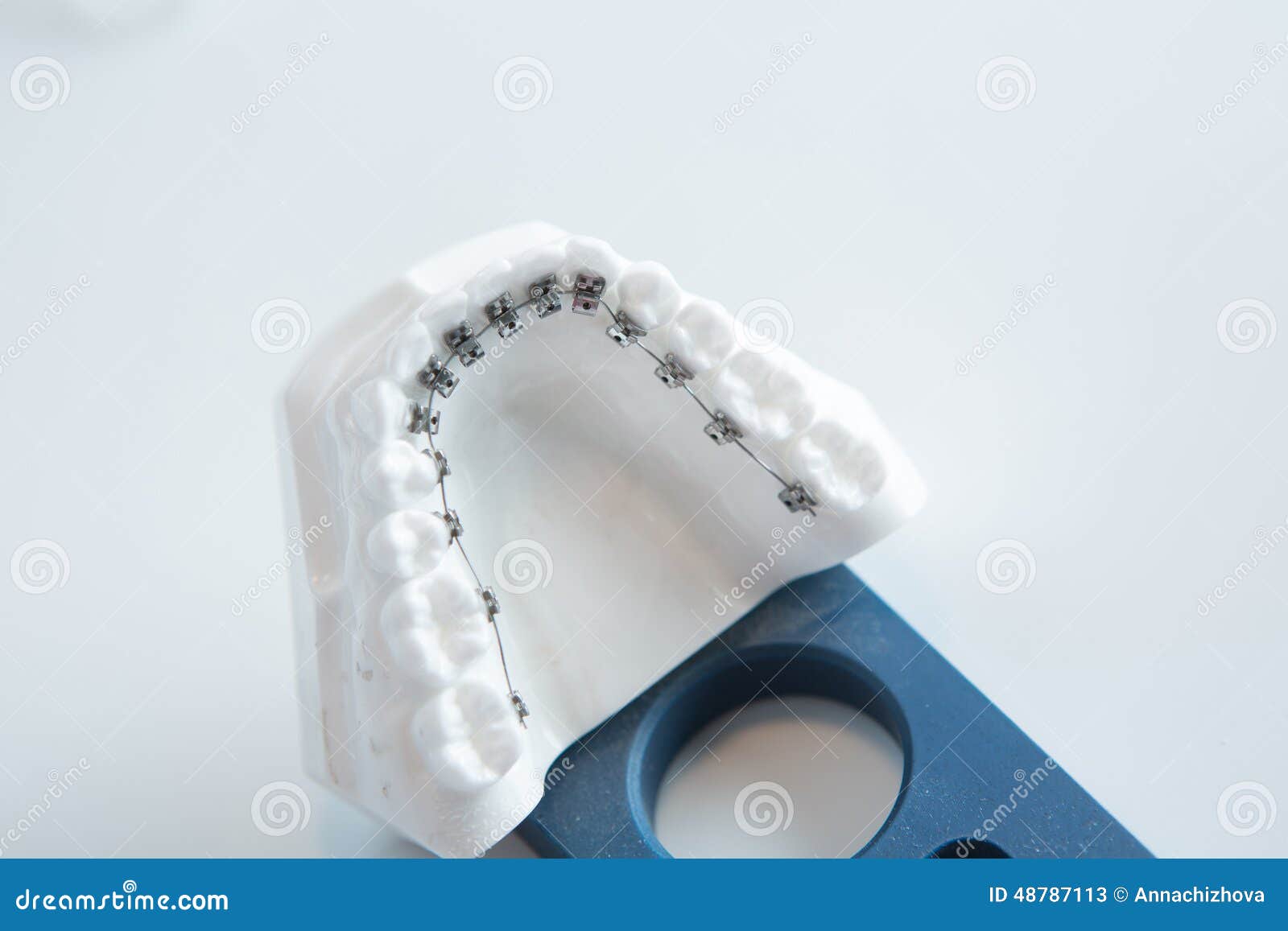 Dental Lower Jaw Bracket Braces Model on White Stock Image - Image of ...