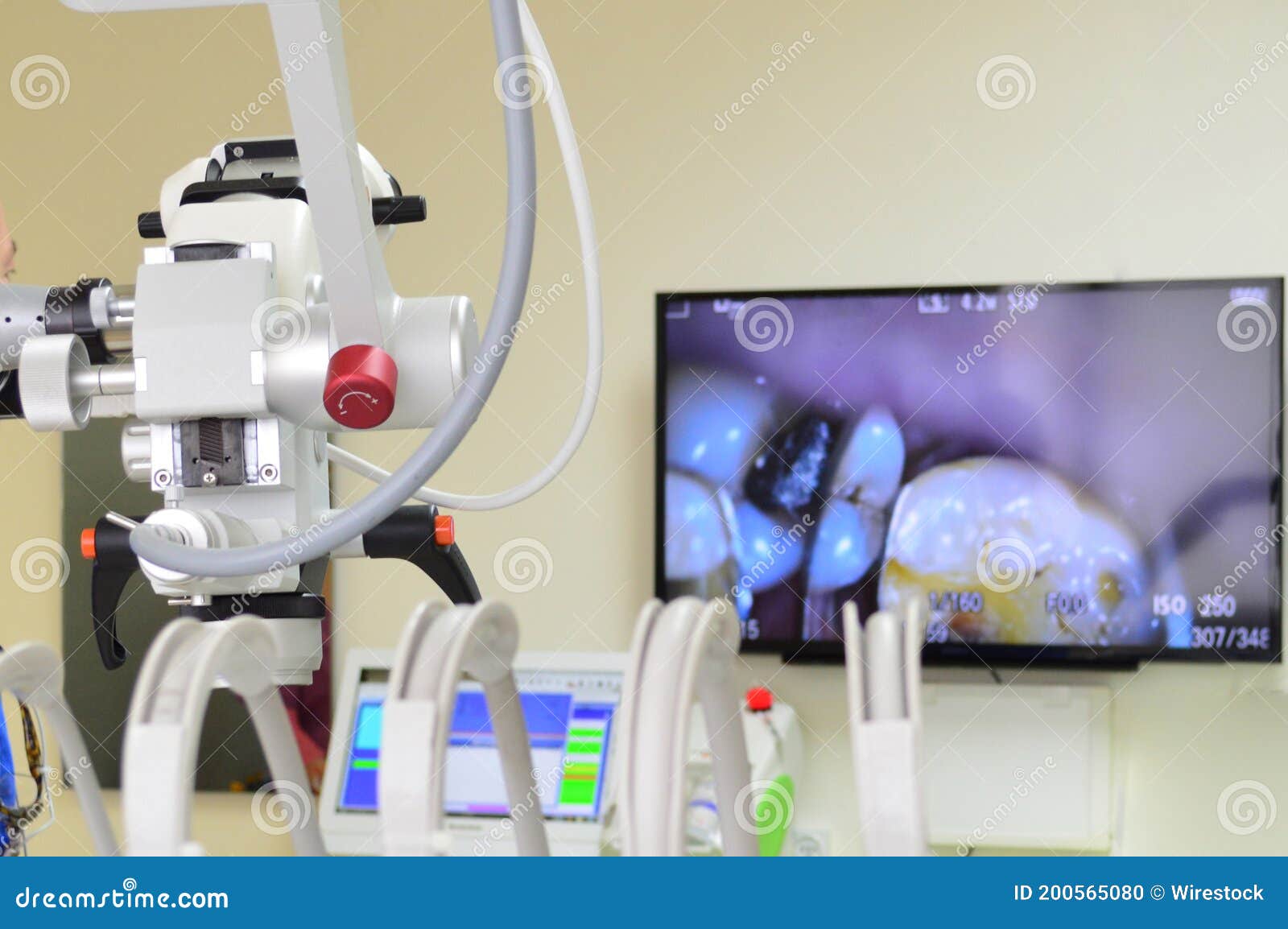 Dental Microscope in Dentistry Stock Photo - Image of dental, patient ...