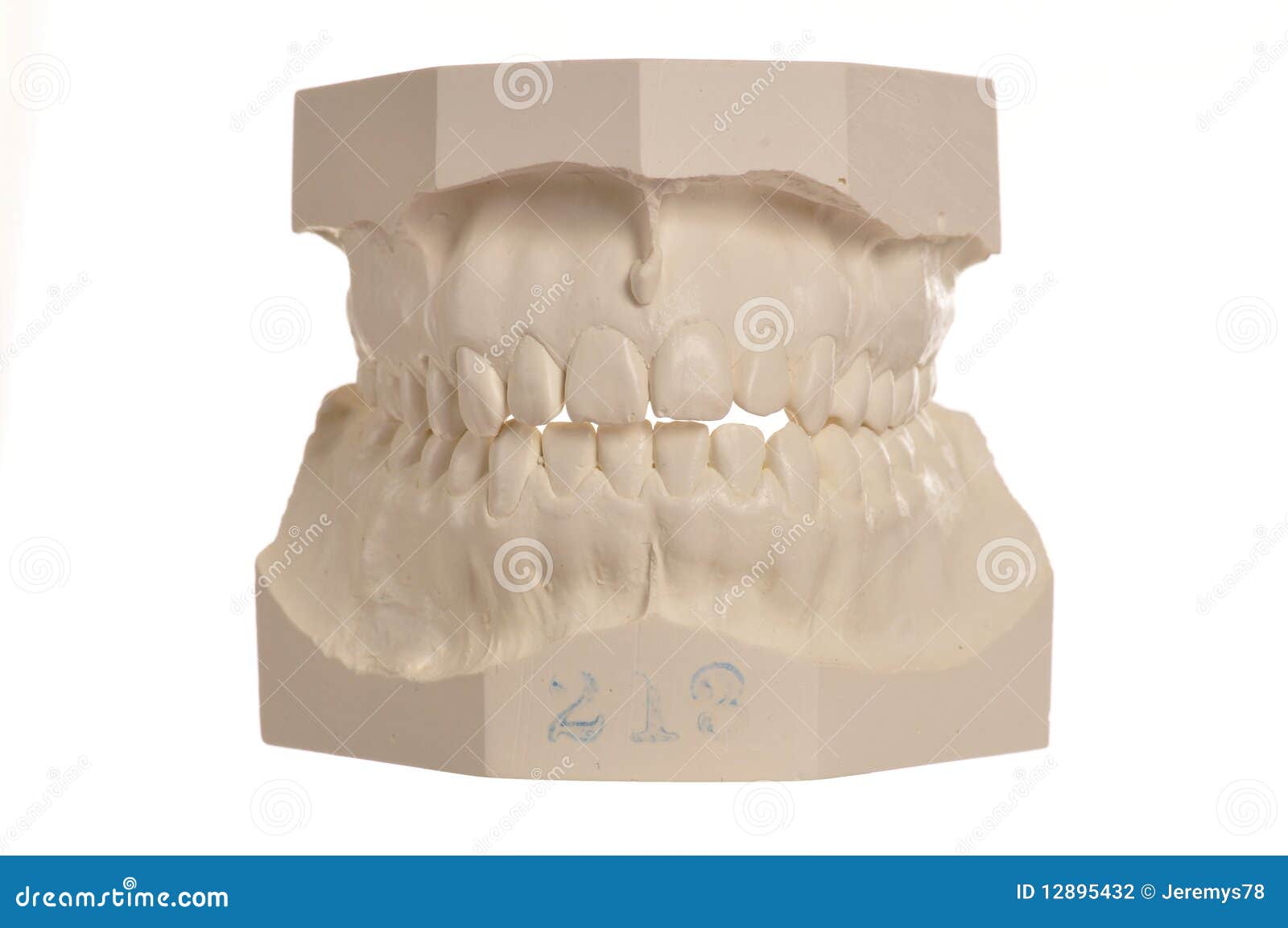 Dental Model of Human Teeth on White Stock Photo - Image of orthodontic ...