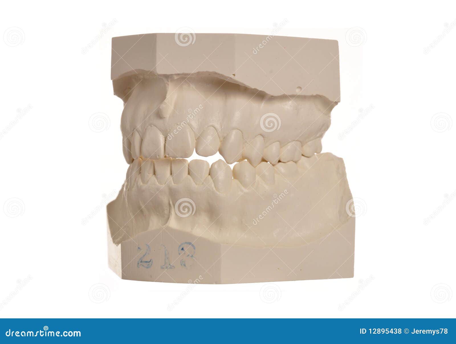 Dental Model of Human Teeth on White Stock Photo - Image of oral ...