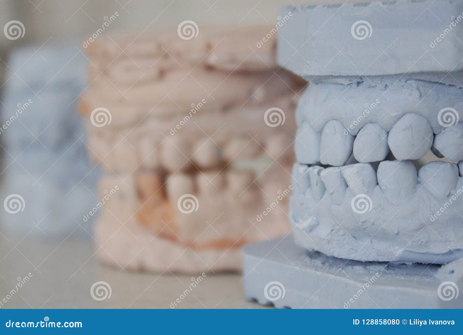 Dental model stock photo. Image of dentist, plaster - 128858080