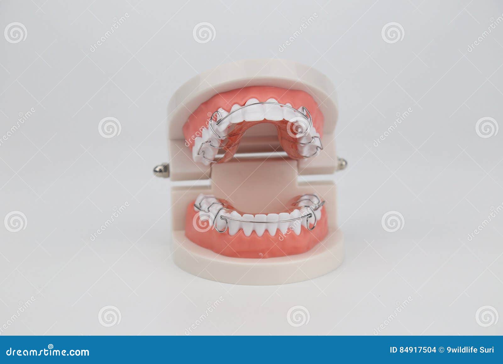 Dental model with retainer stock photo. Image of white - 84917504