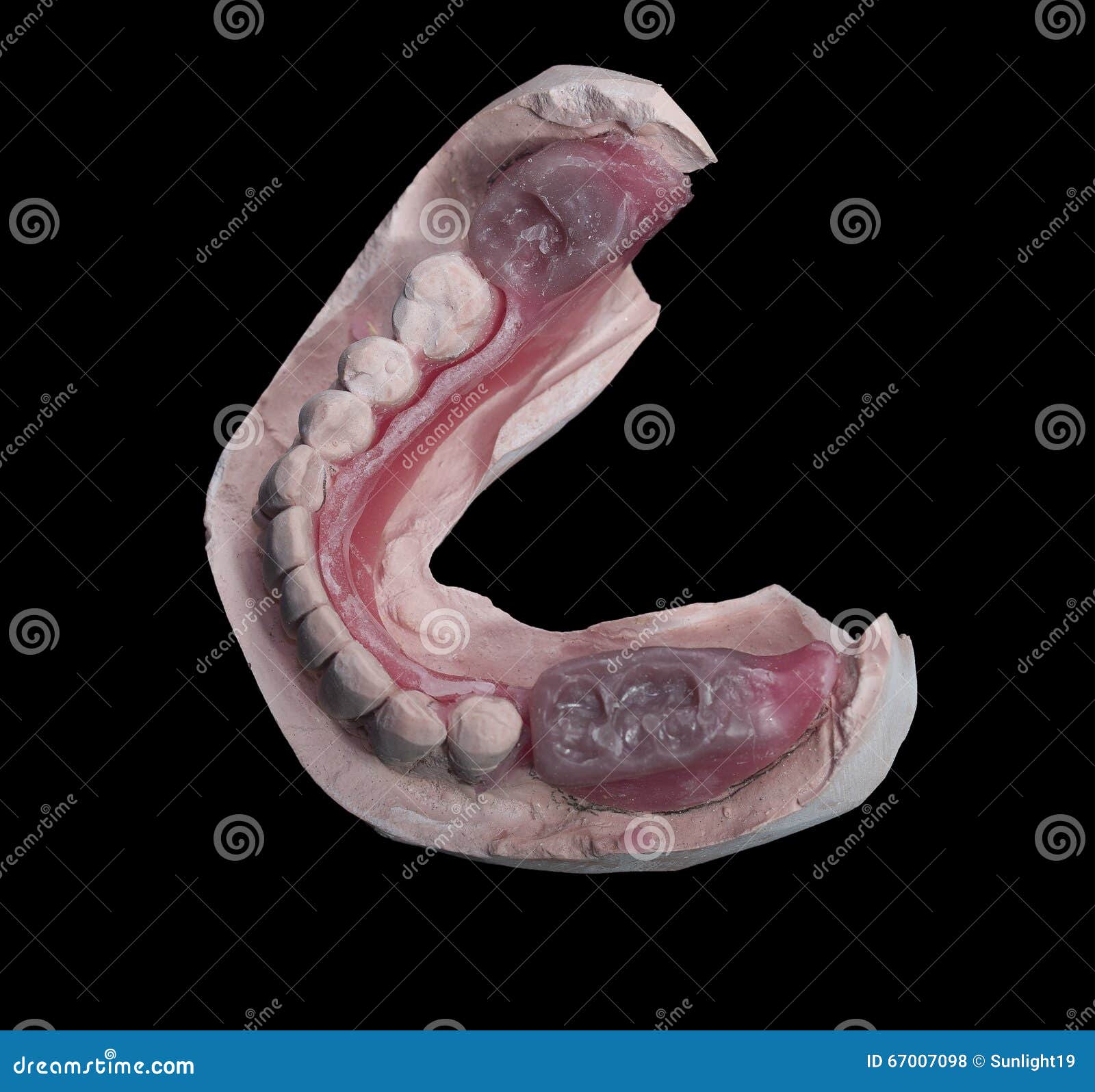 Dental Model with Teeth Made in Wax Stock Photo - Image of upper, model ...