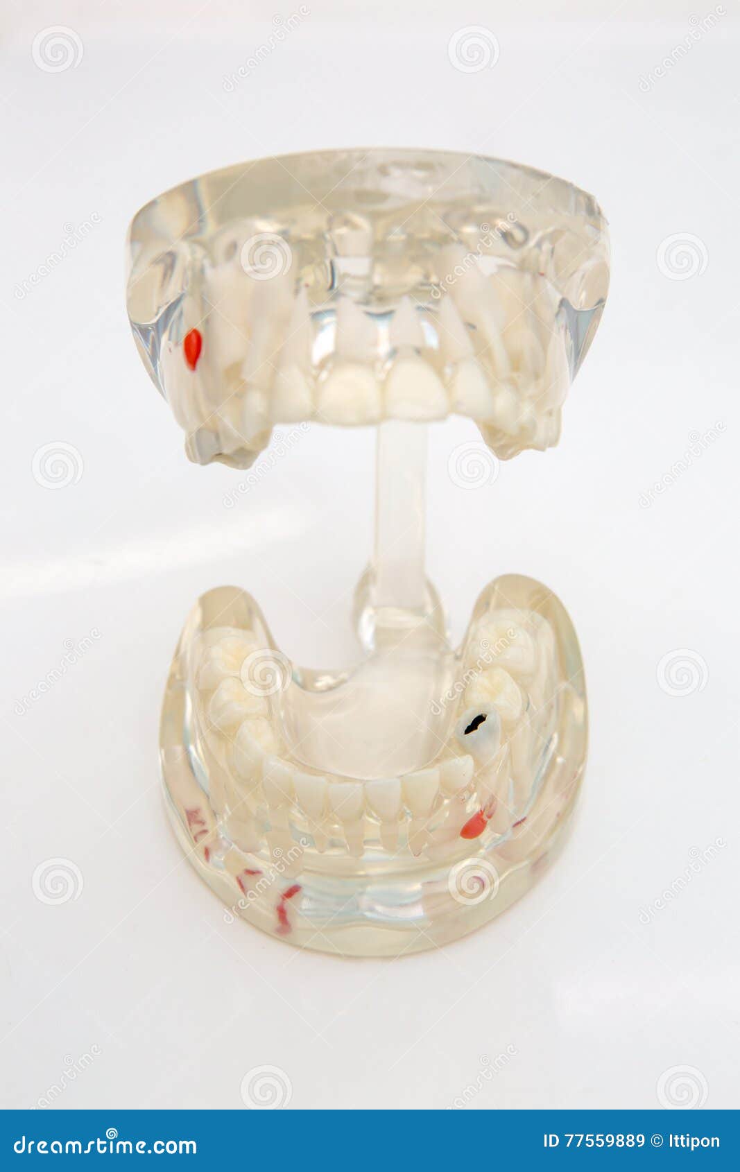Dental model,teeth model stock image. Image of teeth - 77559889