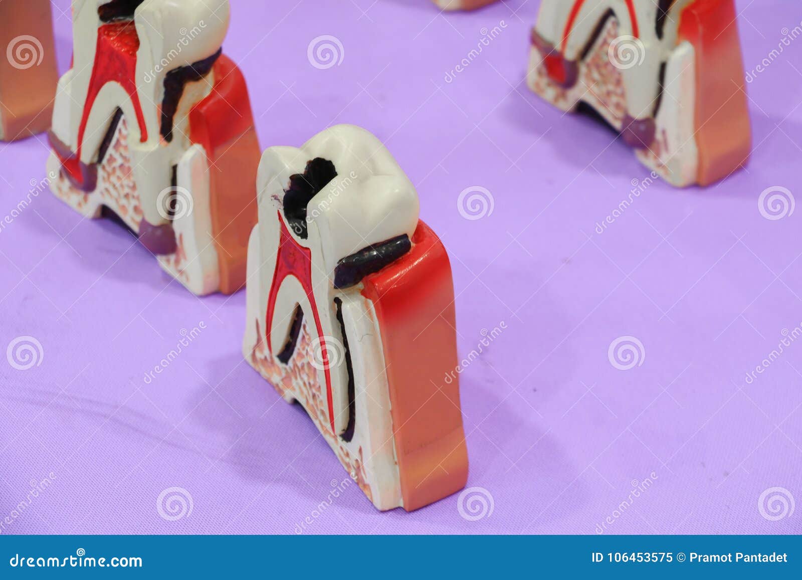 Dental Model of Teeth on a Table Stock Image - Image of conceptual ...