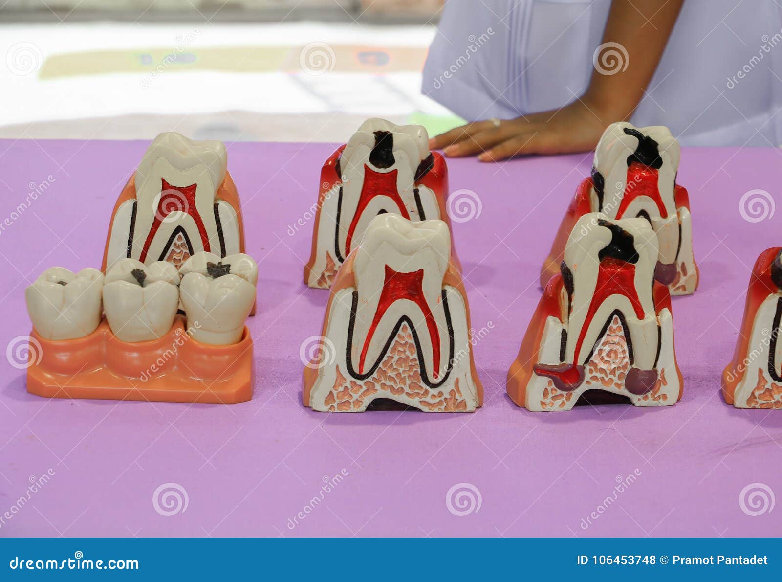 Dental Model of Teeth on a Table Stock Photo - Image of handmade ...