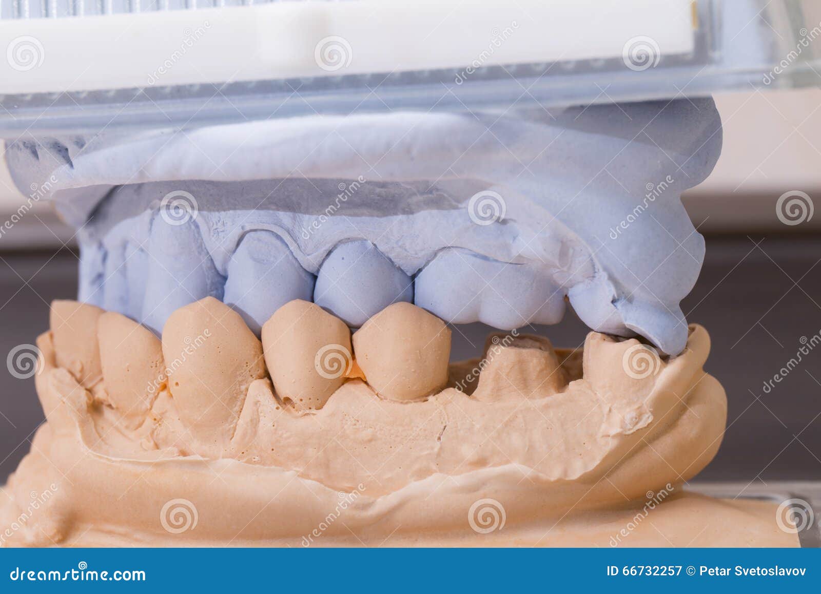 Dental Mold for Prosthetic Teeth Stock Image - Image of care, cermet ...