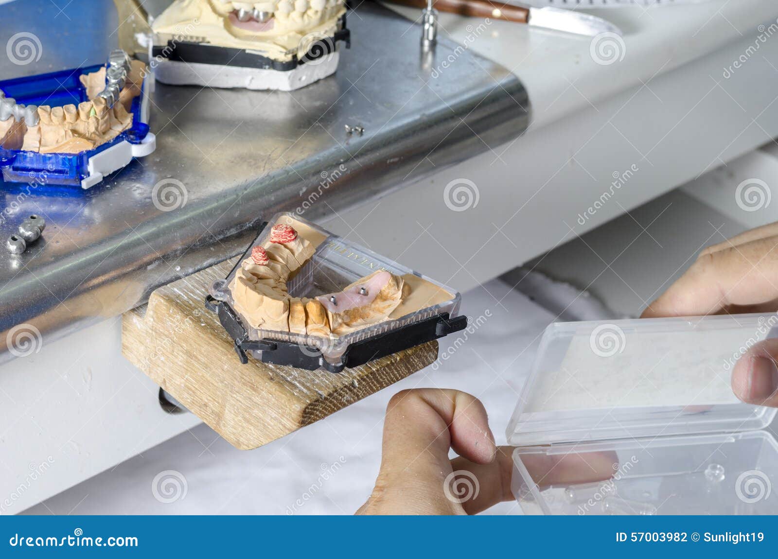 Dental Molds of Human Teeth Stock Photo - Image of dentist, endodontics ...