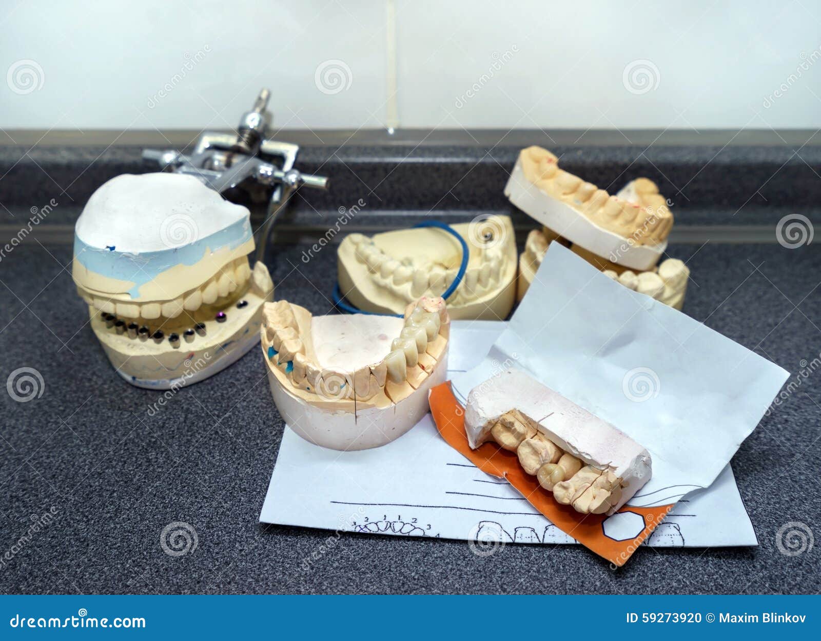 Dental Molds for Prosthetic Teeth Stock Photo - Image of equipment ...