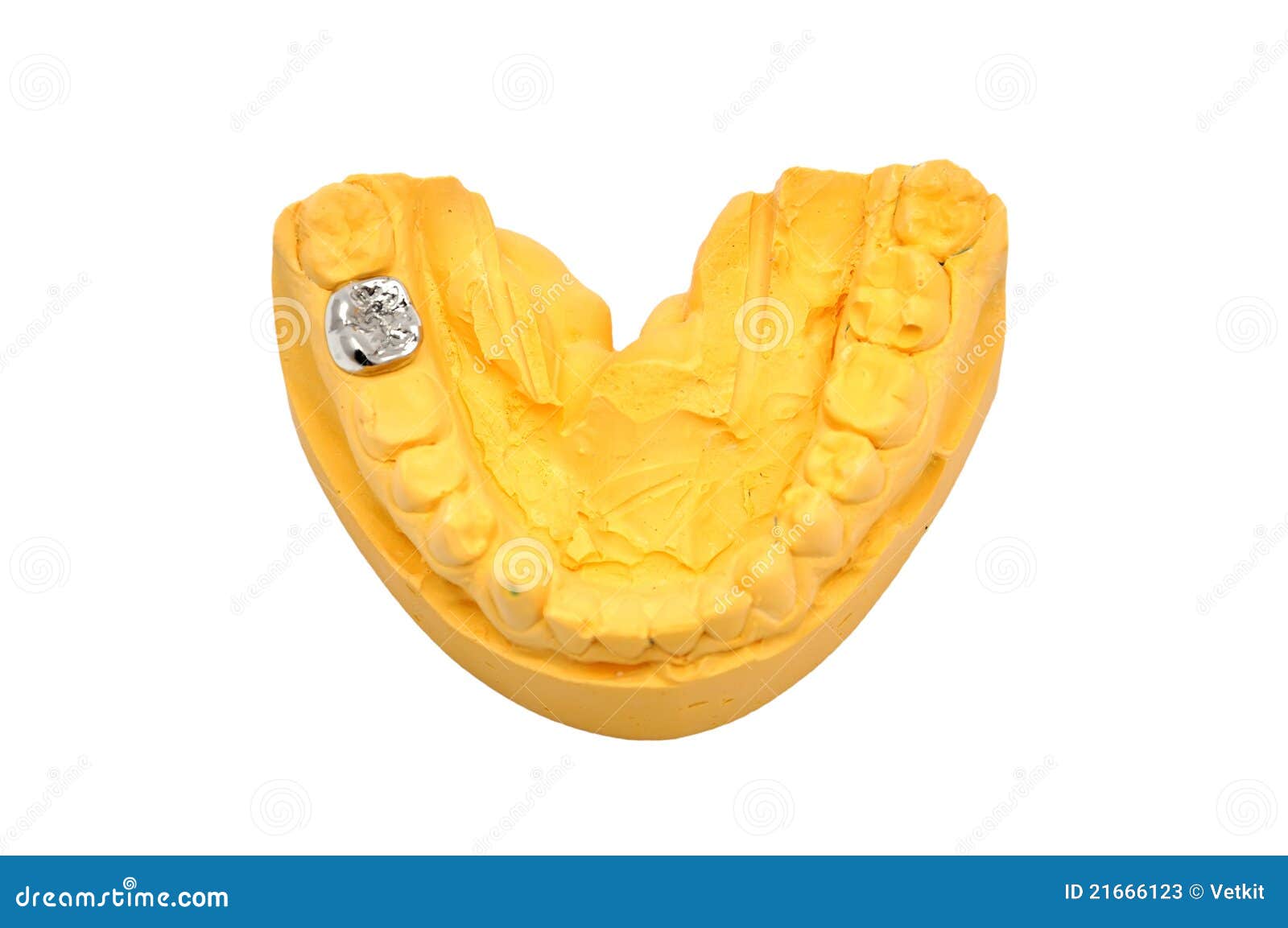 Dental mould stock image. Image of dentistry, teeth, molds - 21666123