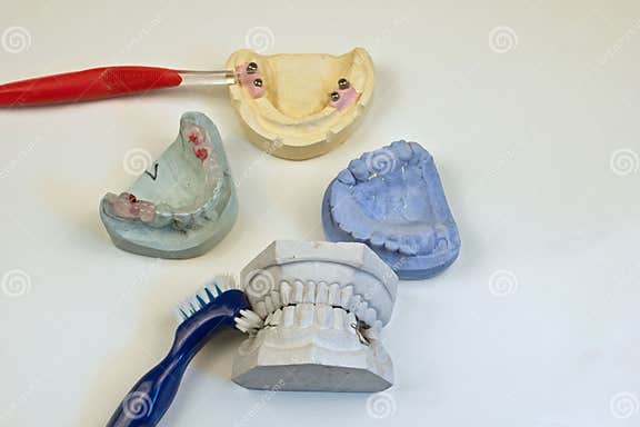 Dental mould stock photo. Image of model, dentistry, square - 43532708