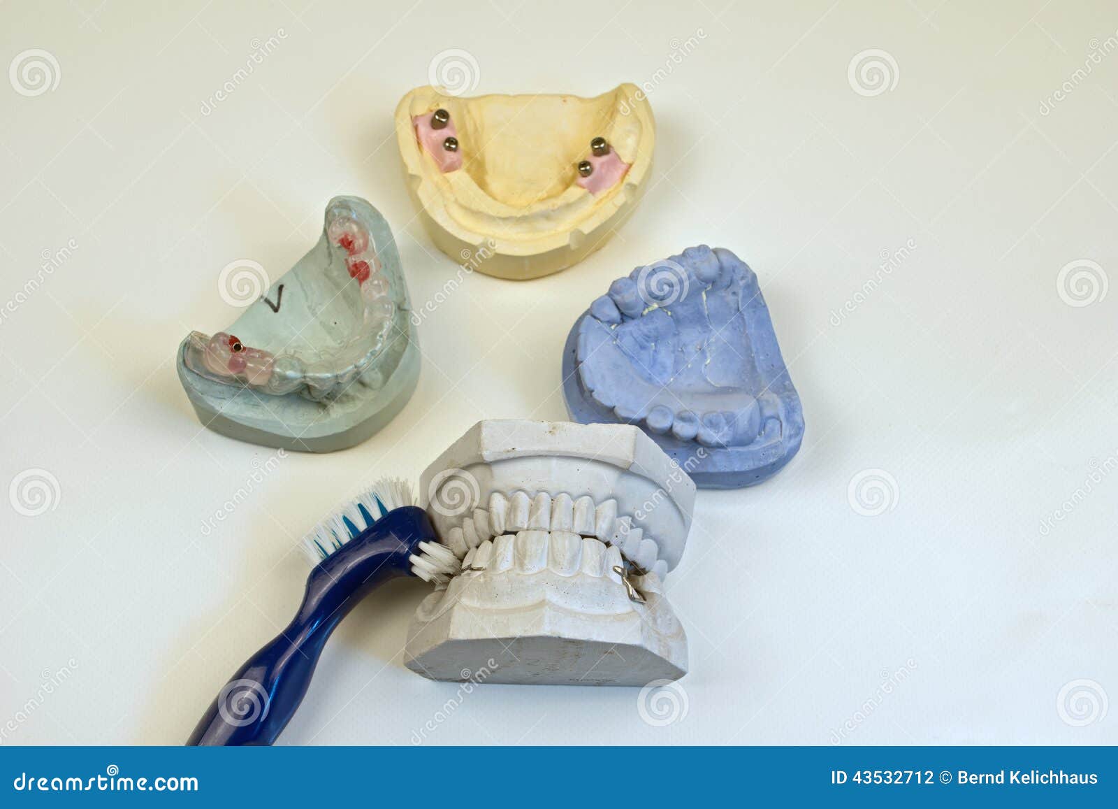Dental mould stock photo. Image of implant, chew, prosthesis - 43532712