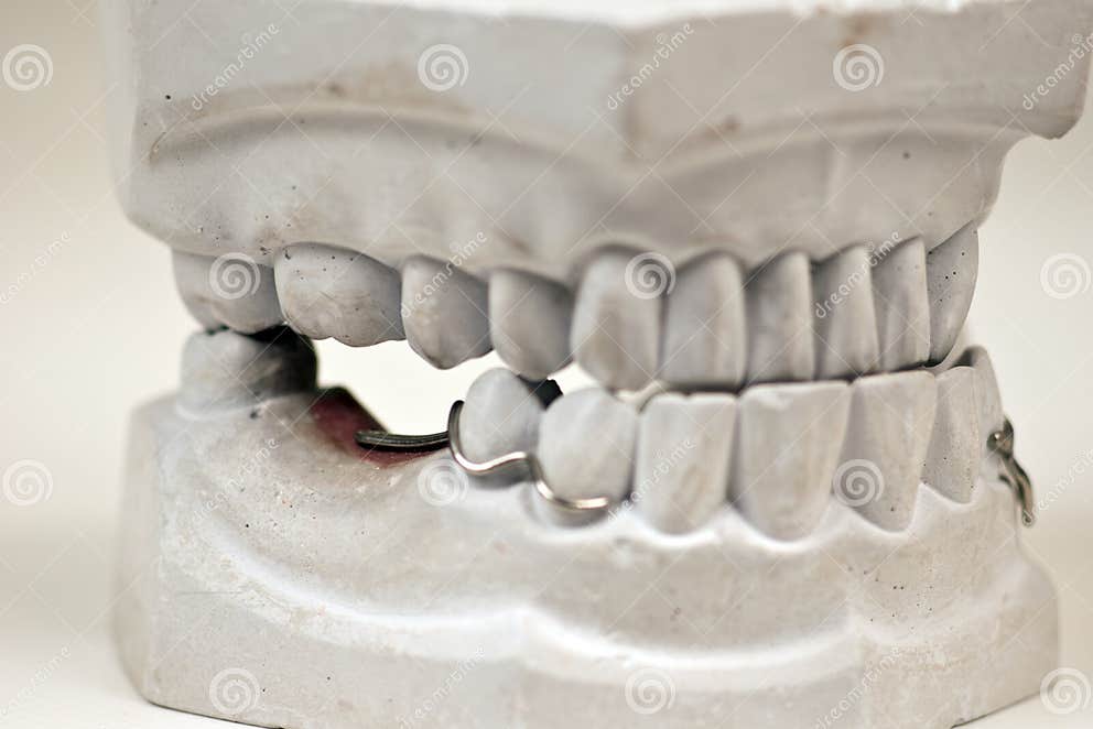 Dental mould stock image. Image of chew, impression, figure - 43533065
