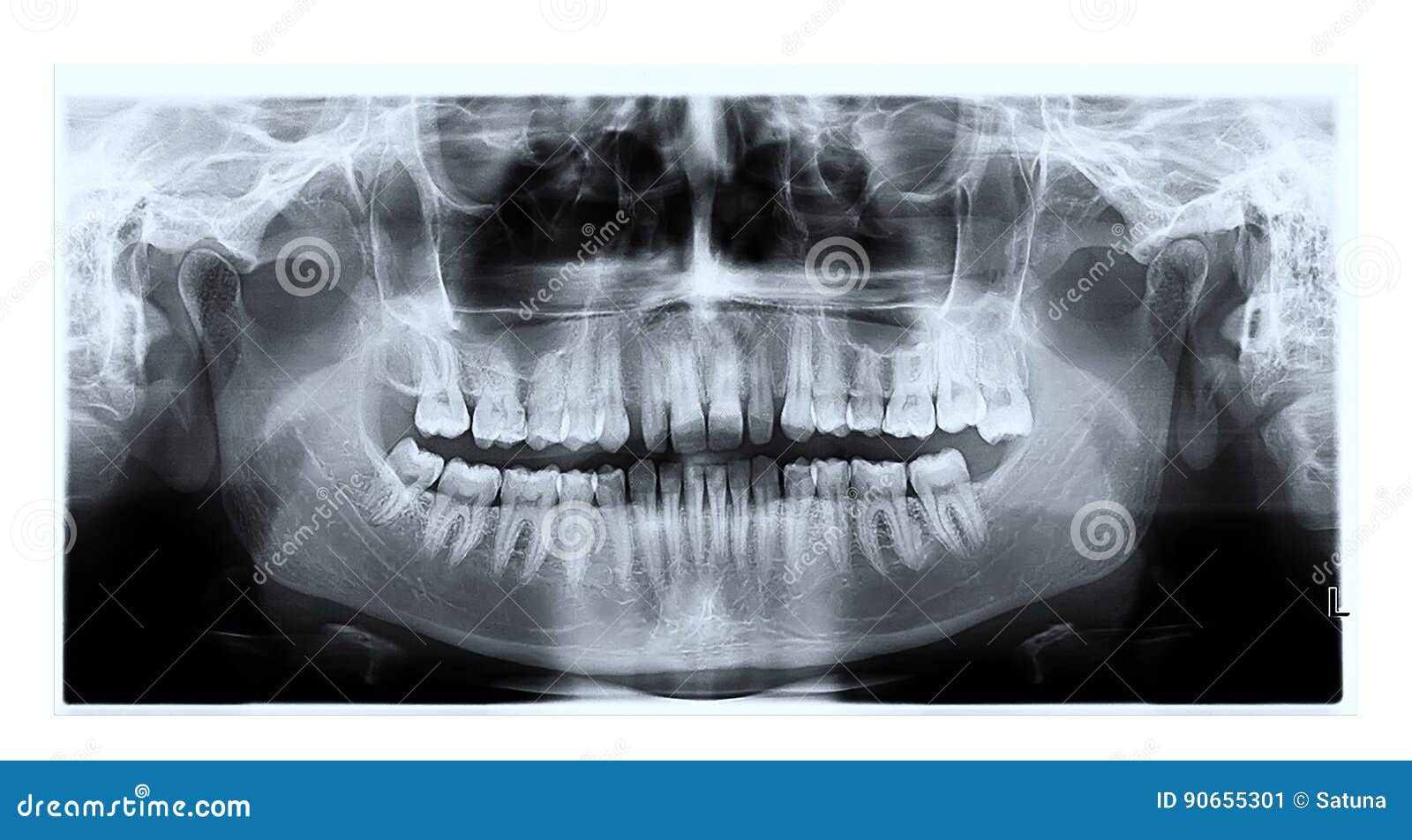 Dental Panoramic Radiograph Machine Stock Photography | CartoonDealer ...
