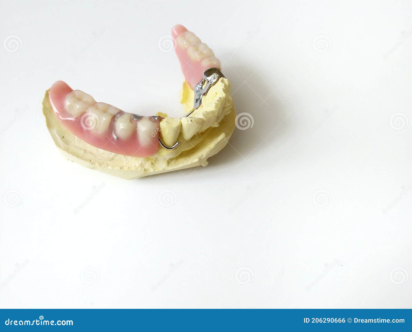 Dental Partial Denture in Mandible Stock Photo - Image of resin, oral ...