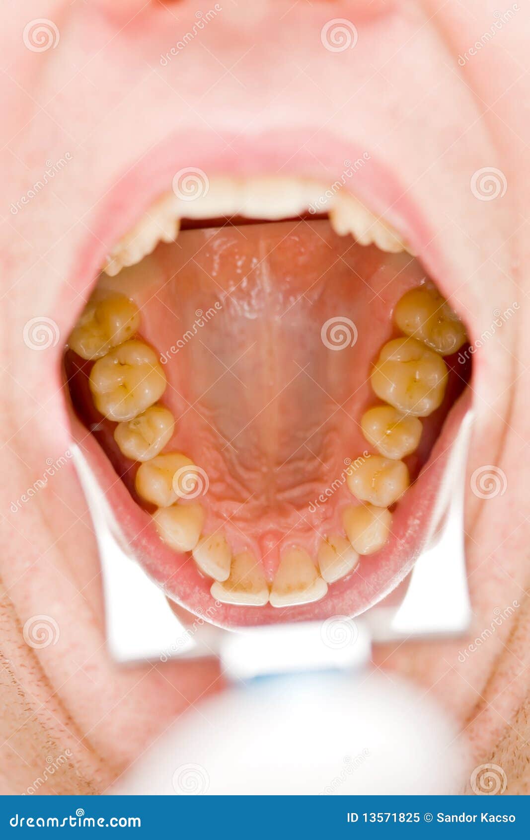 Dental photography stock image. Image of tooth, bony - 13571825