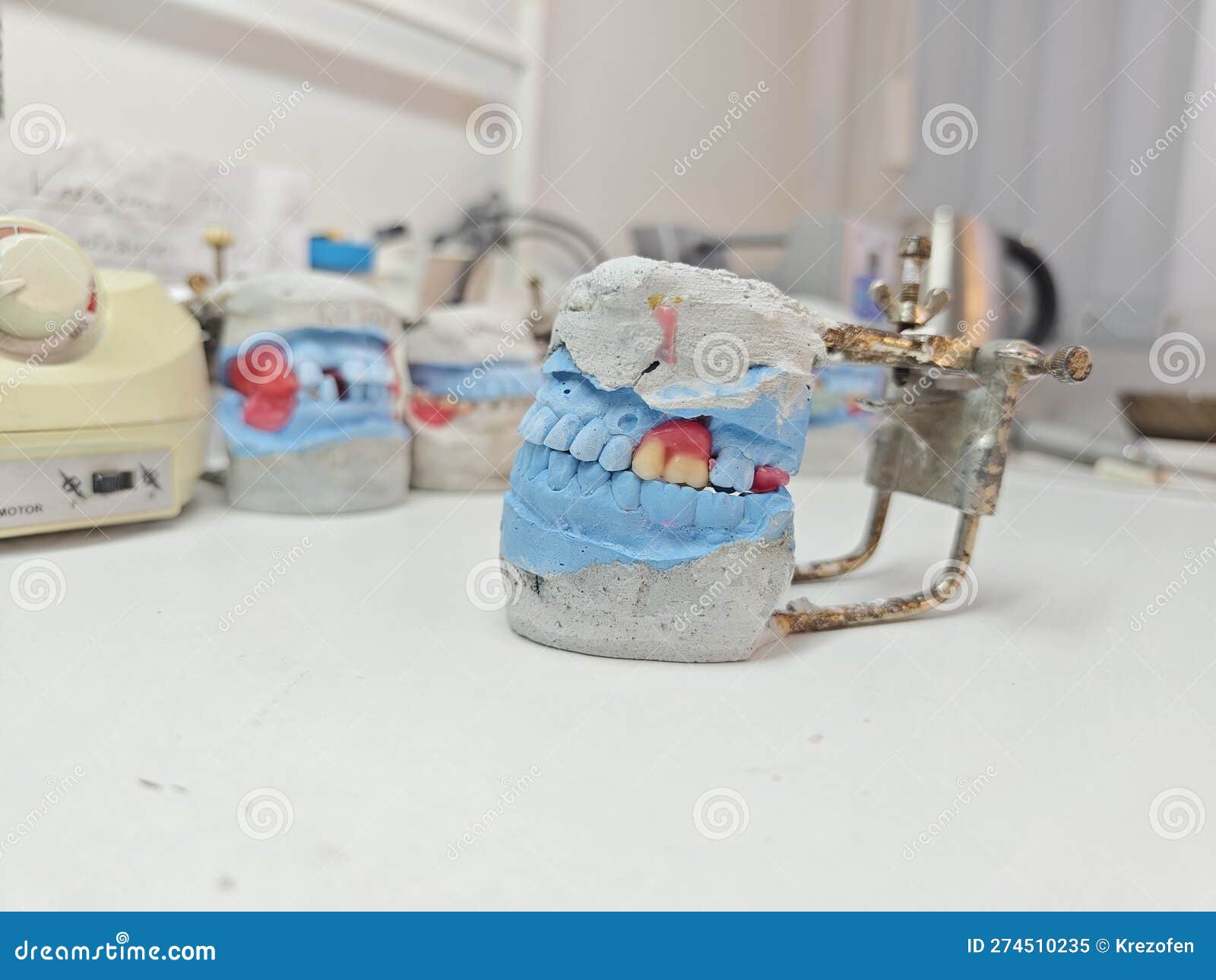 Dental Plaster Models with Denture Analogs in the Dental Laboratory ...