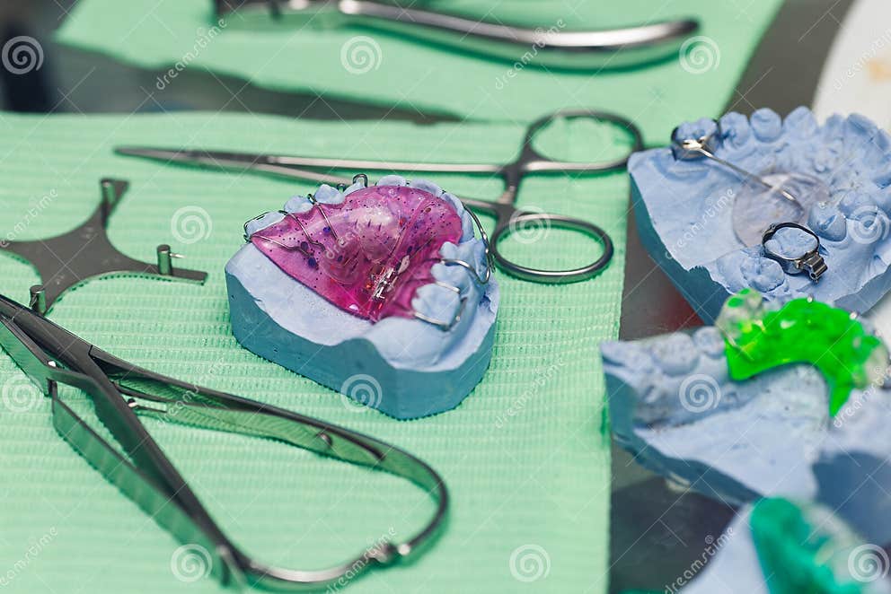 Dental Plates on an Artificial Jaw. Dental Instruments on the Desktop ...