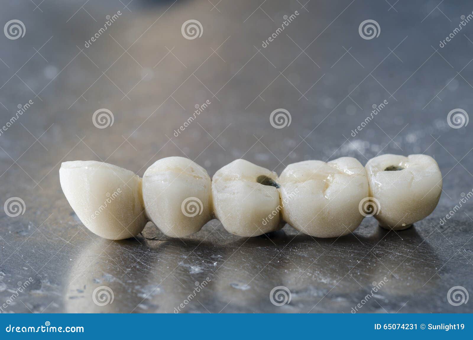 Dental porcelain bridge. stock image. Image of impression - 65074231