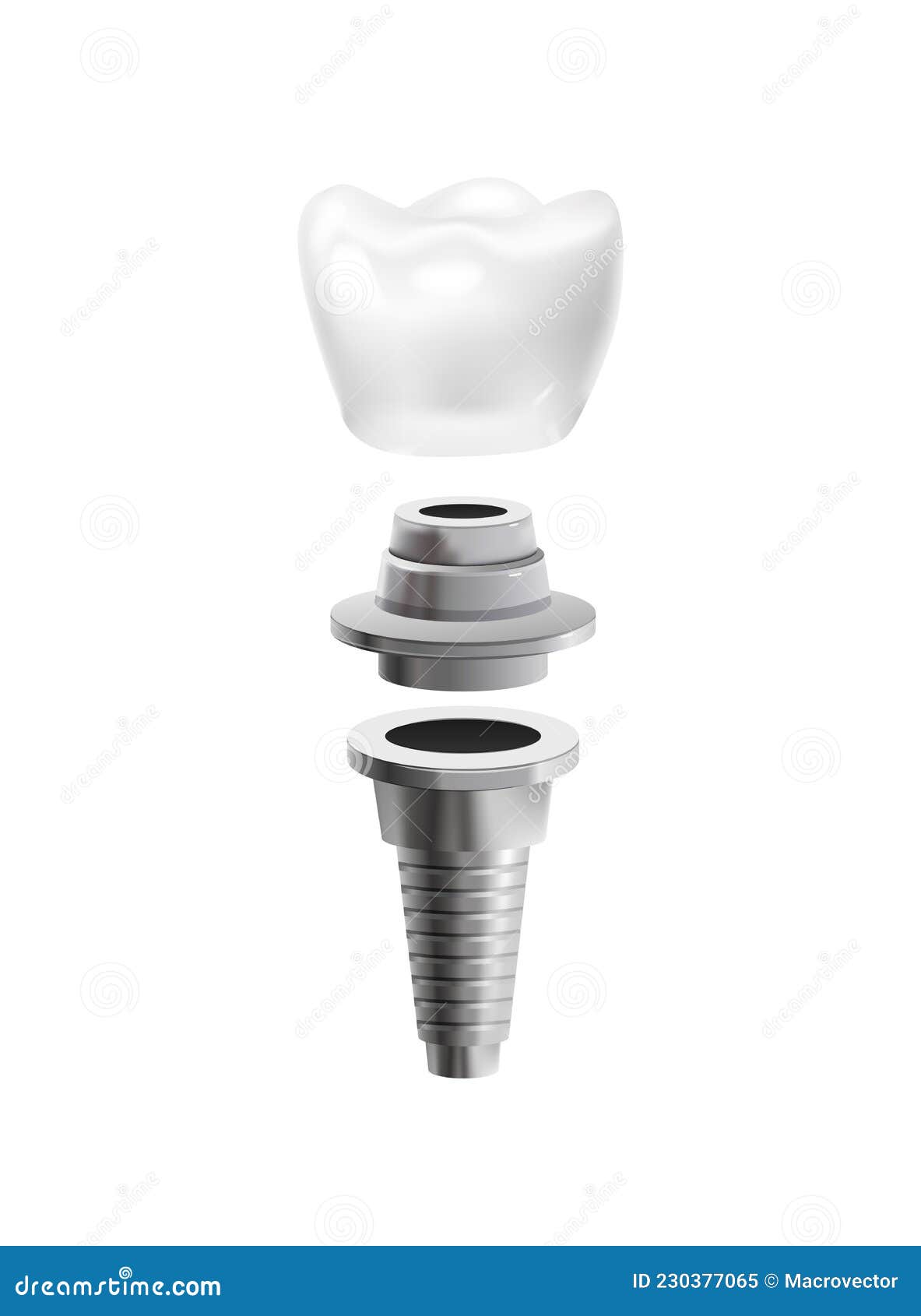 Dental Post Icon stock vector. Illustration of pulp - 230377065
