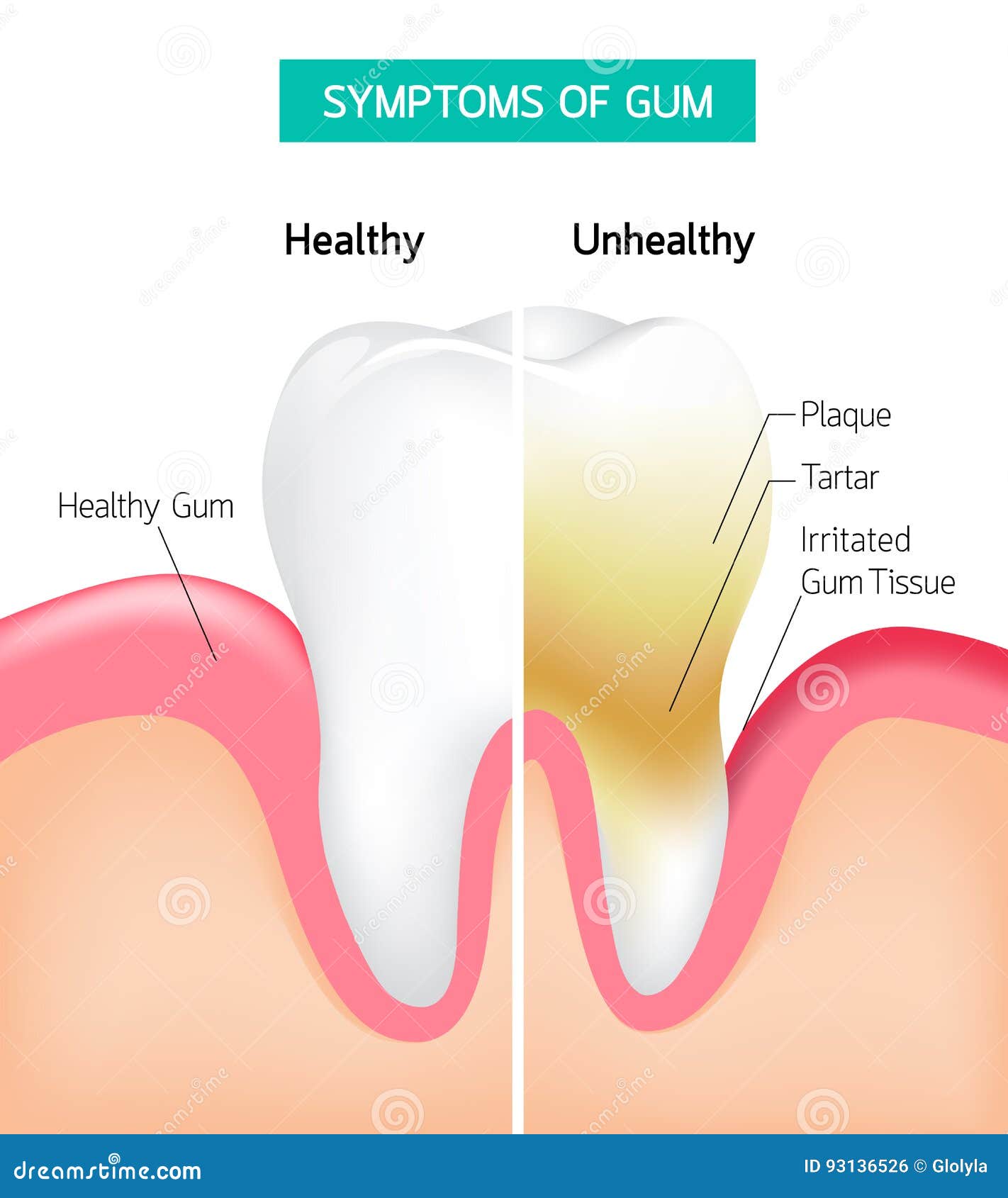 Dental Problem Health Care Comparison Healthy Unhealthy Tooth Hygiene ... Dental Problem Health Care Comparison Healthy Unhealthy Tooth Hygiene ...