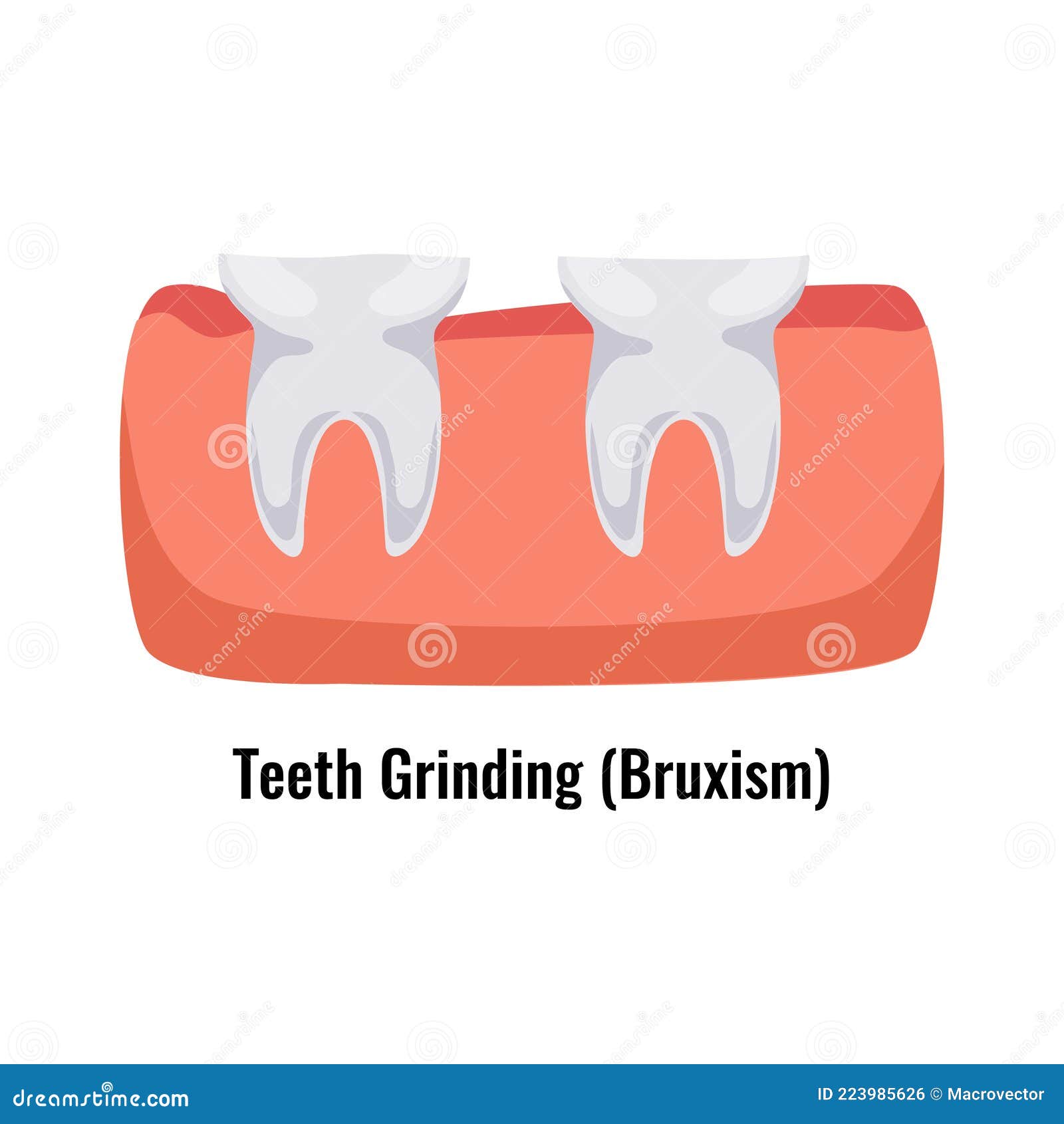 Dental Problem Poster stock vector. Illustration of anatomy - 223985626